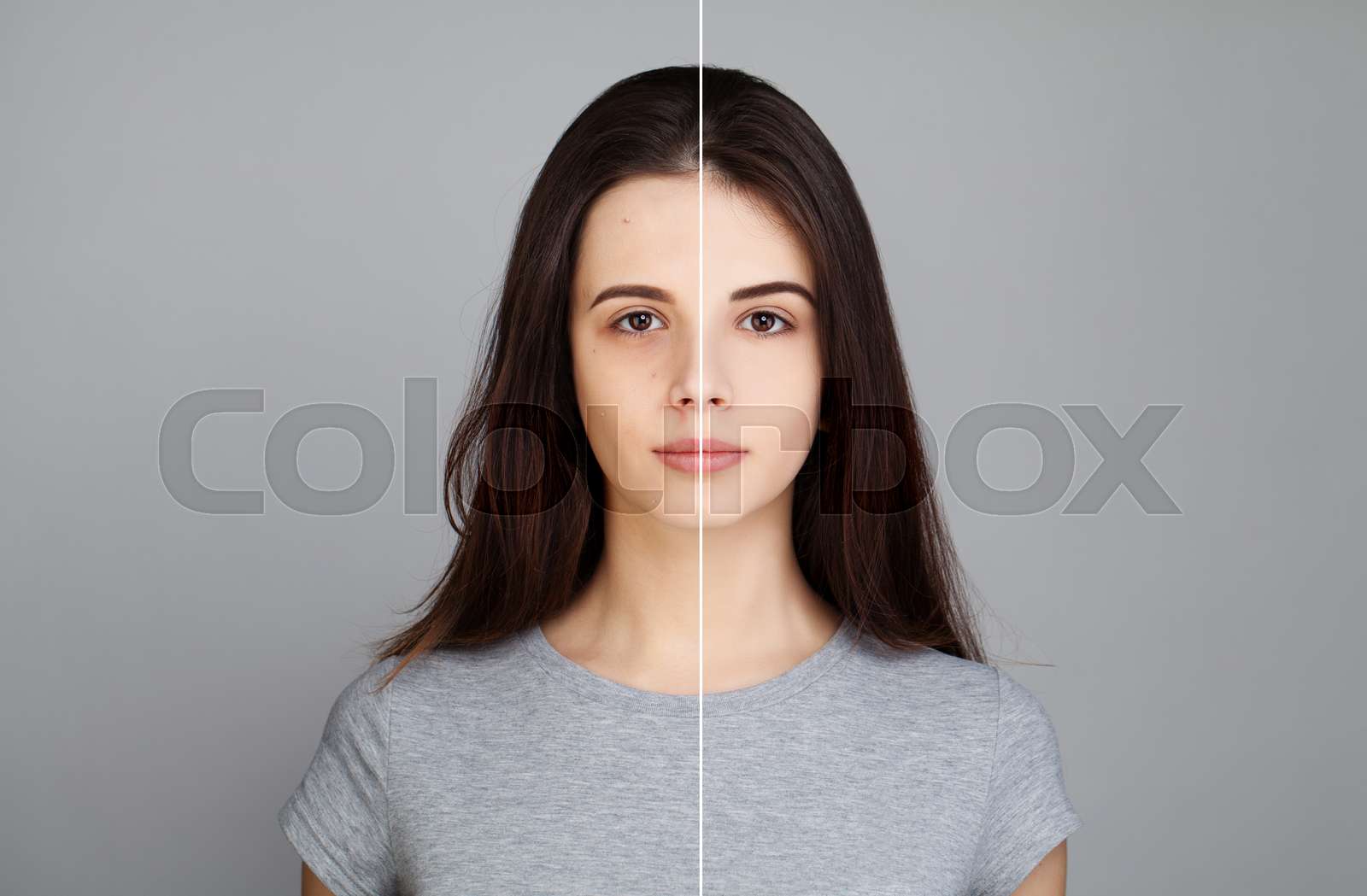 Young Model Woman with Skin Problem. Female Face, Healthy and Unhealthy ...