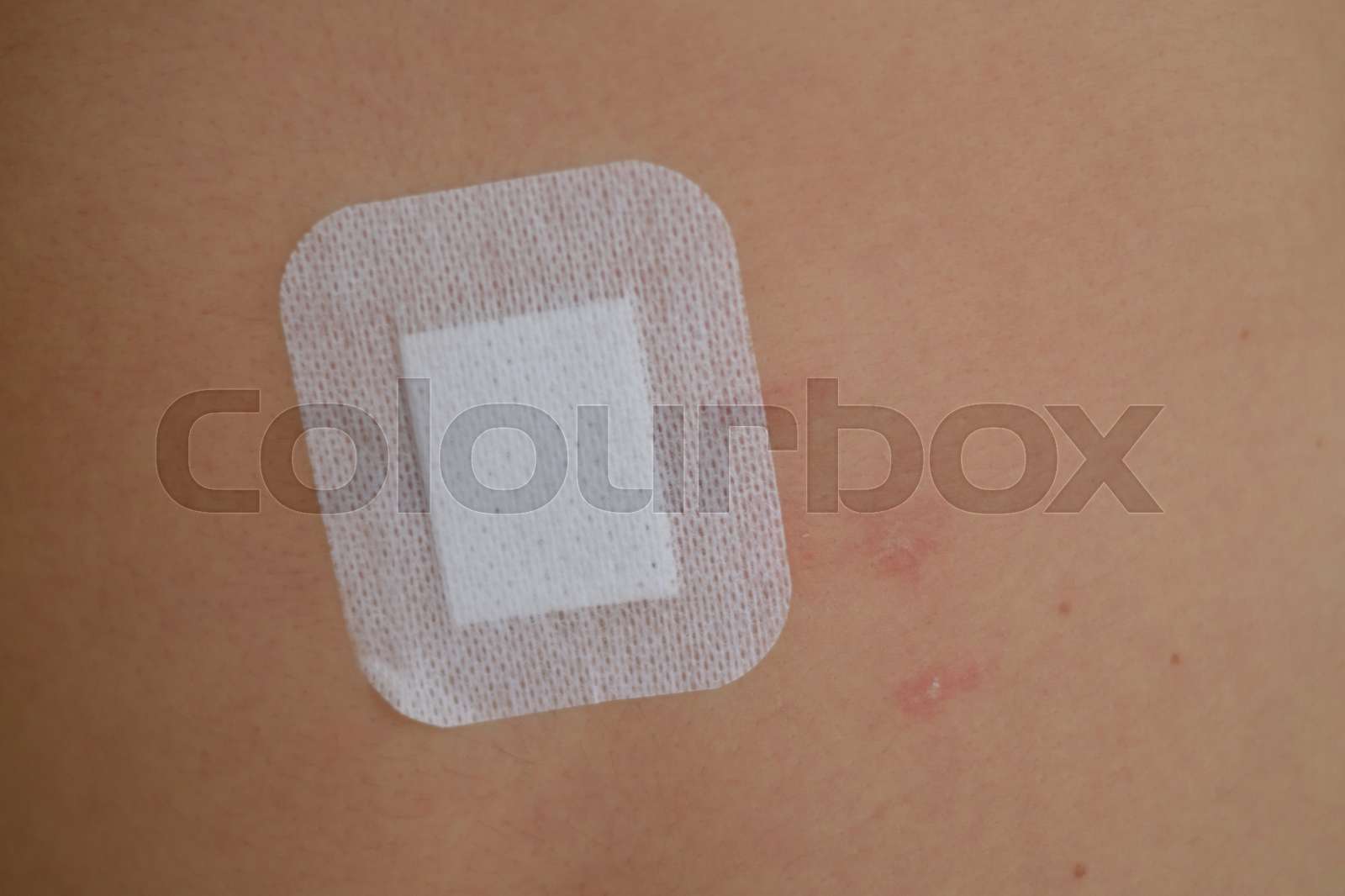 Pflaster auf Wunde | Stock Bild | Colourbox