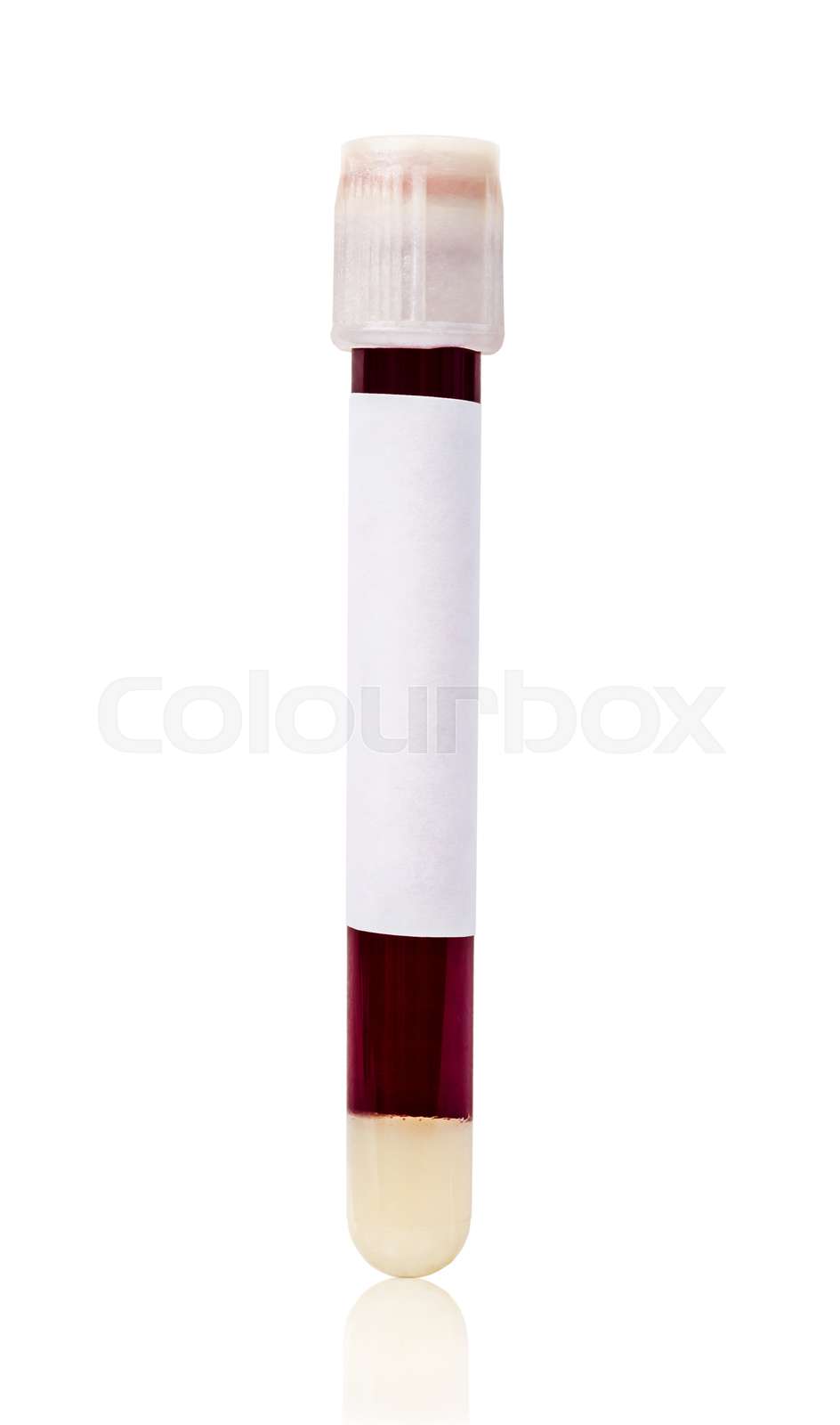 White vacuum blood tube test with sample blood. | Stock image | Colourbox