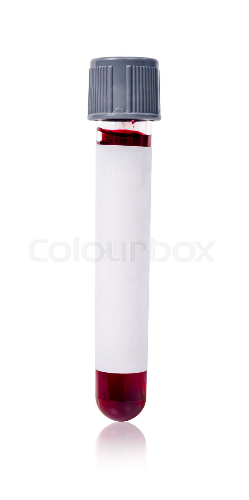 Grey vacuum blood tube test with sample blood. | Stock image | Colourbox