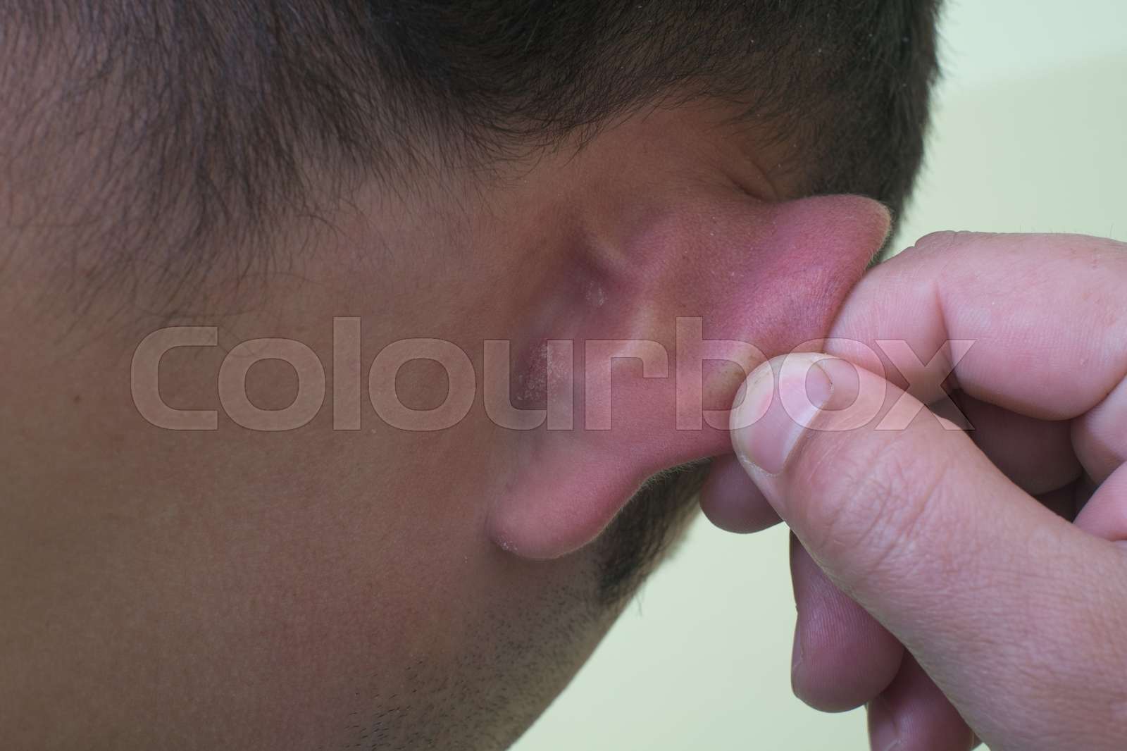 Psoriasis behind the ear, pushes the ear, dermatological problems, skin ...