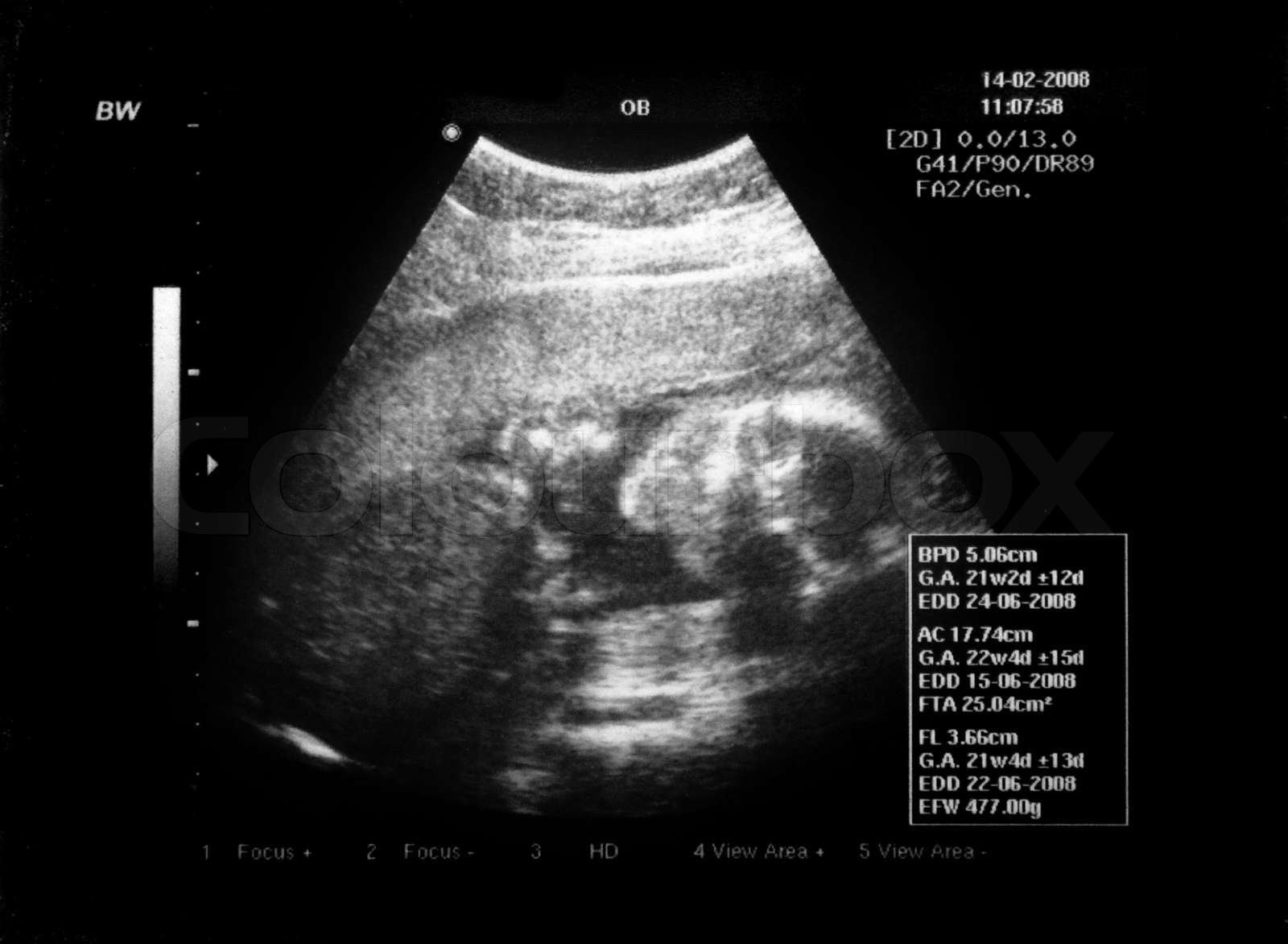 Baby im Bauch der Mutter | Stock Bild | Colourbox