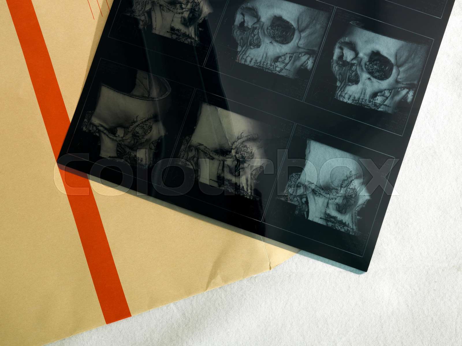 X-ray and envelope | Stock image | Colourbox