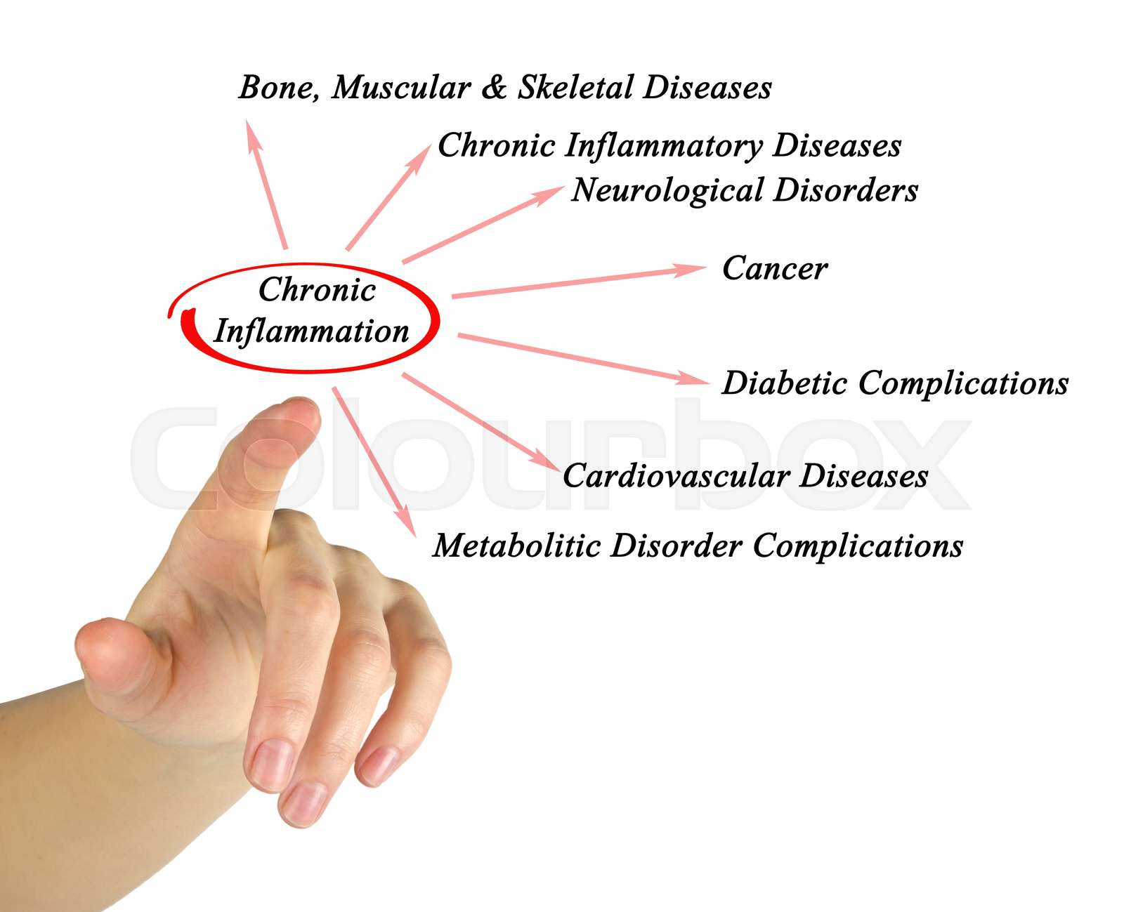 Chronic Inflammation | Stock image | Colourbox