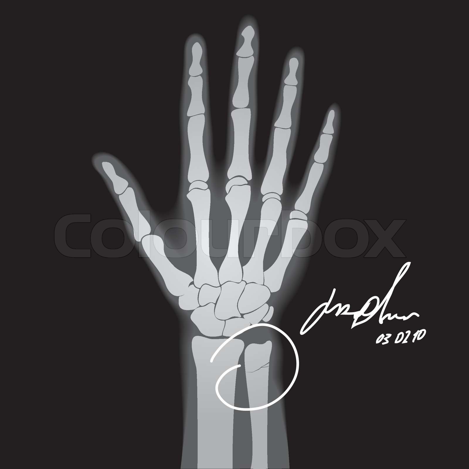 X-ray hand | Stock vector | Colourbox