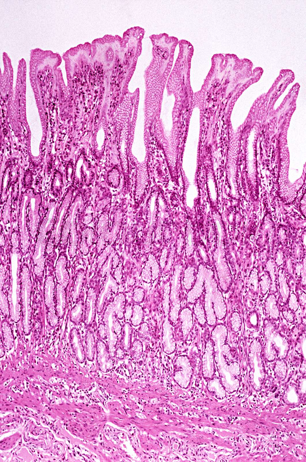 Pylorus mucosa | Stock image | Colourbox