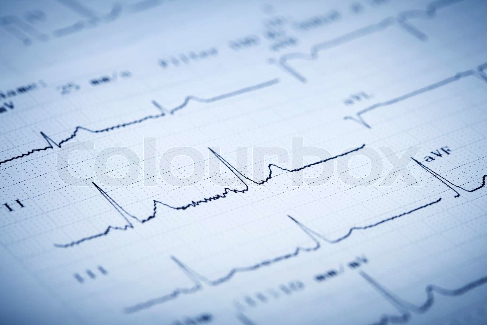 Electrocardiogram | Stock image | Colourbox