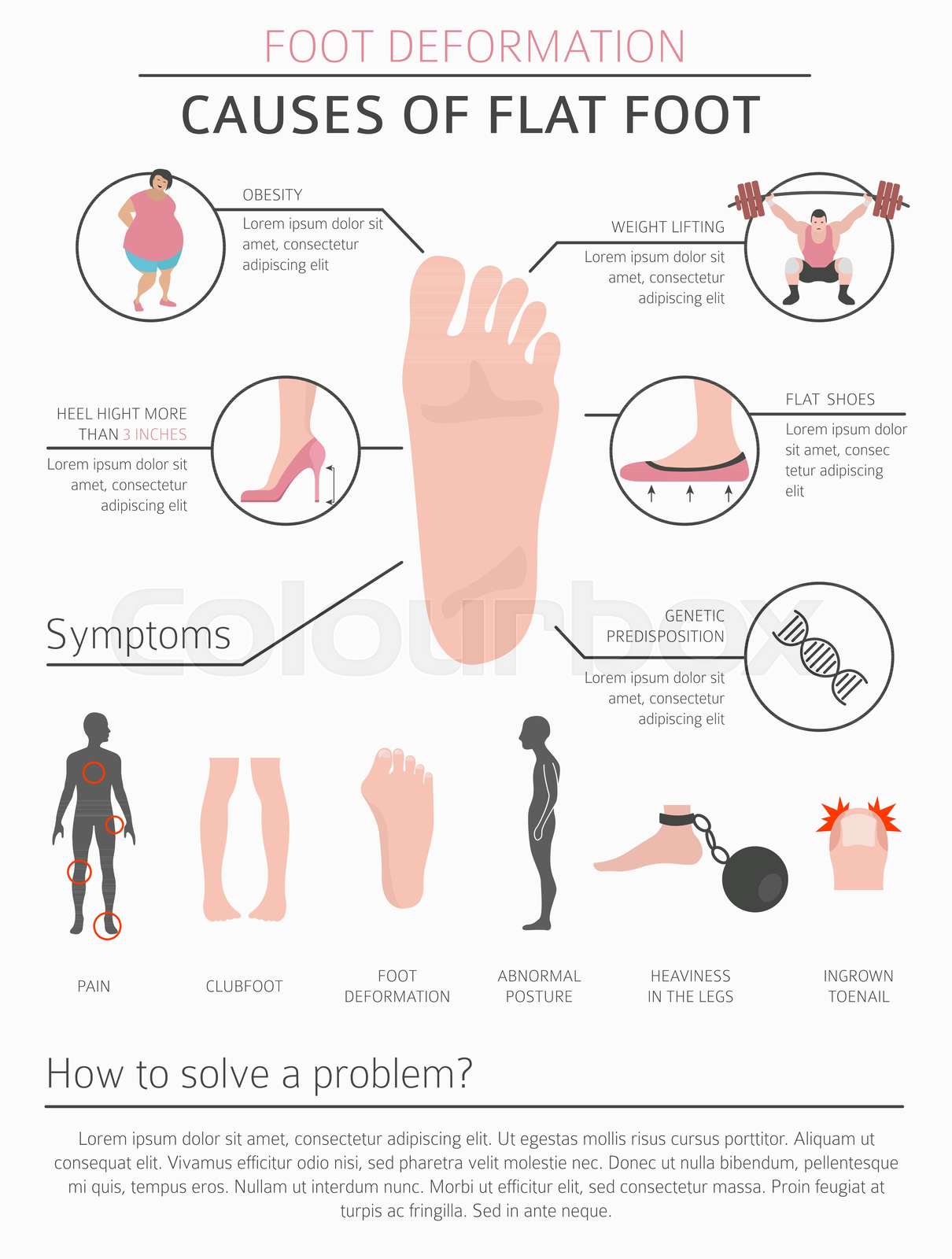 Foot deformation as medical desease infographic. Causes of Flat foot ...