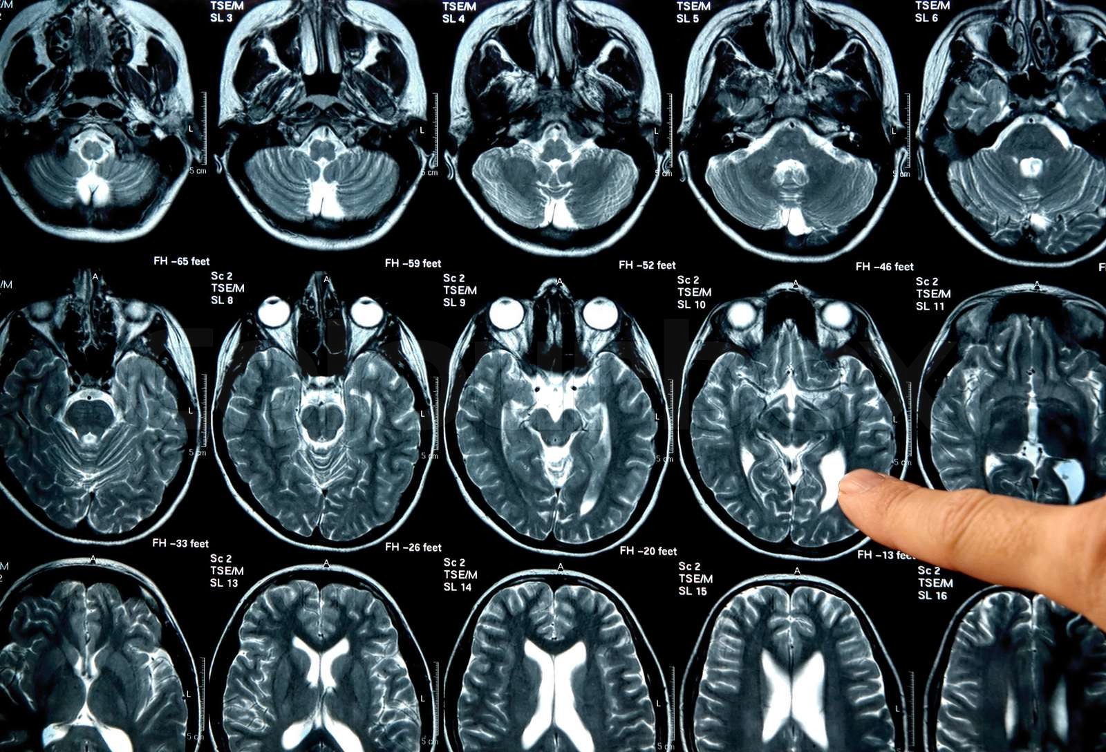 Ein Arzt untersucht ein Röntgen des Kopfes | Stock Bild | Colourbox