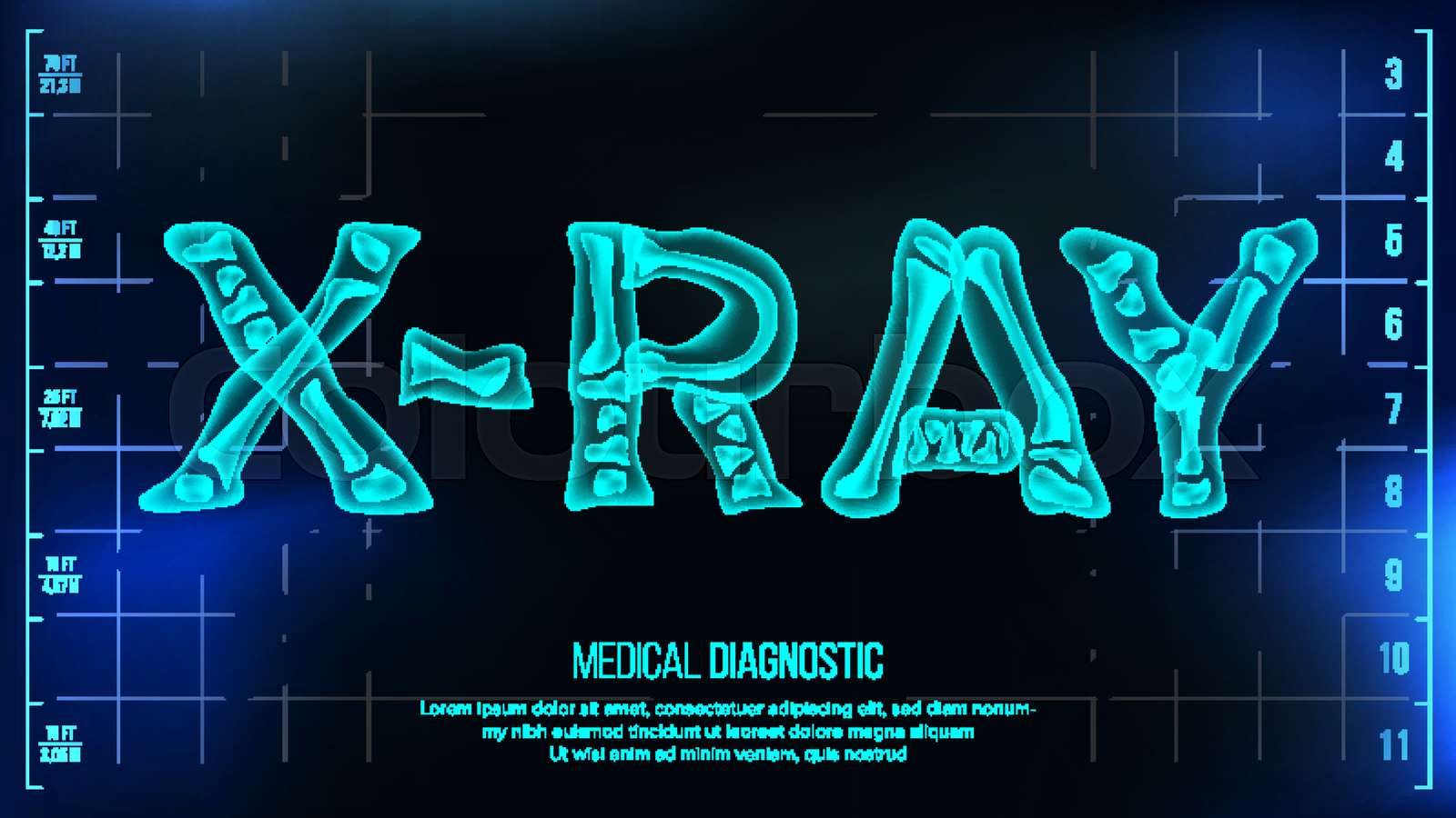 X-ray Banner Vector. Medical Background. Transparent Roentgen X-Ray ...