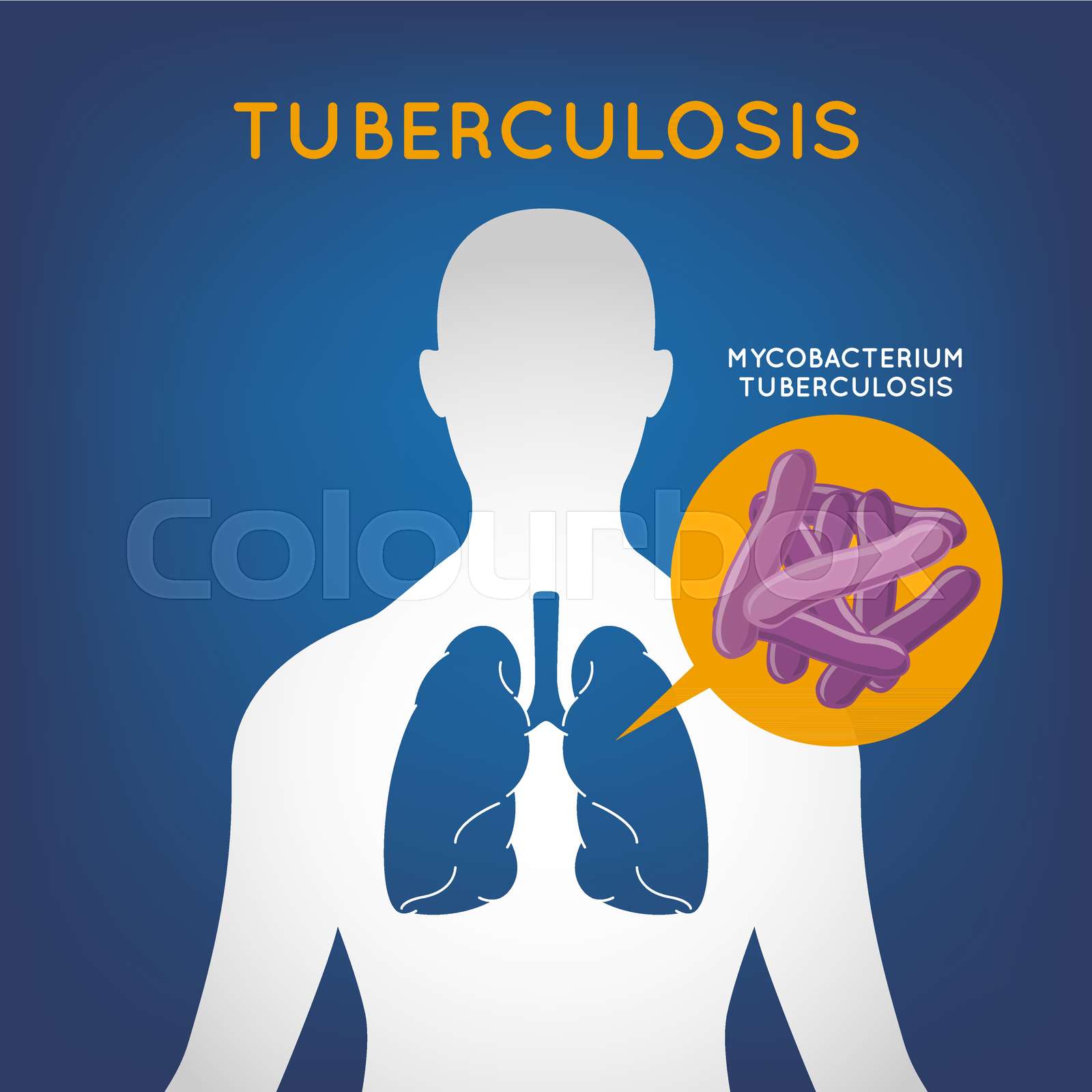 TUBERCULOSIS vector logo icon illustration | Stock vector | Colourbox