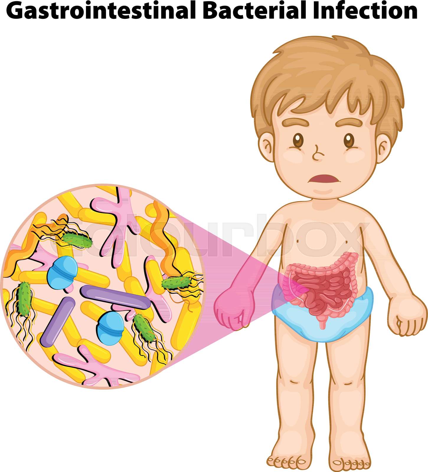 Boy and gastrointestinal bacterial infection | Stock vector | Colourbox