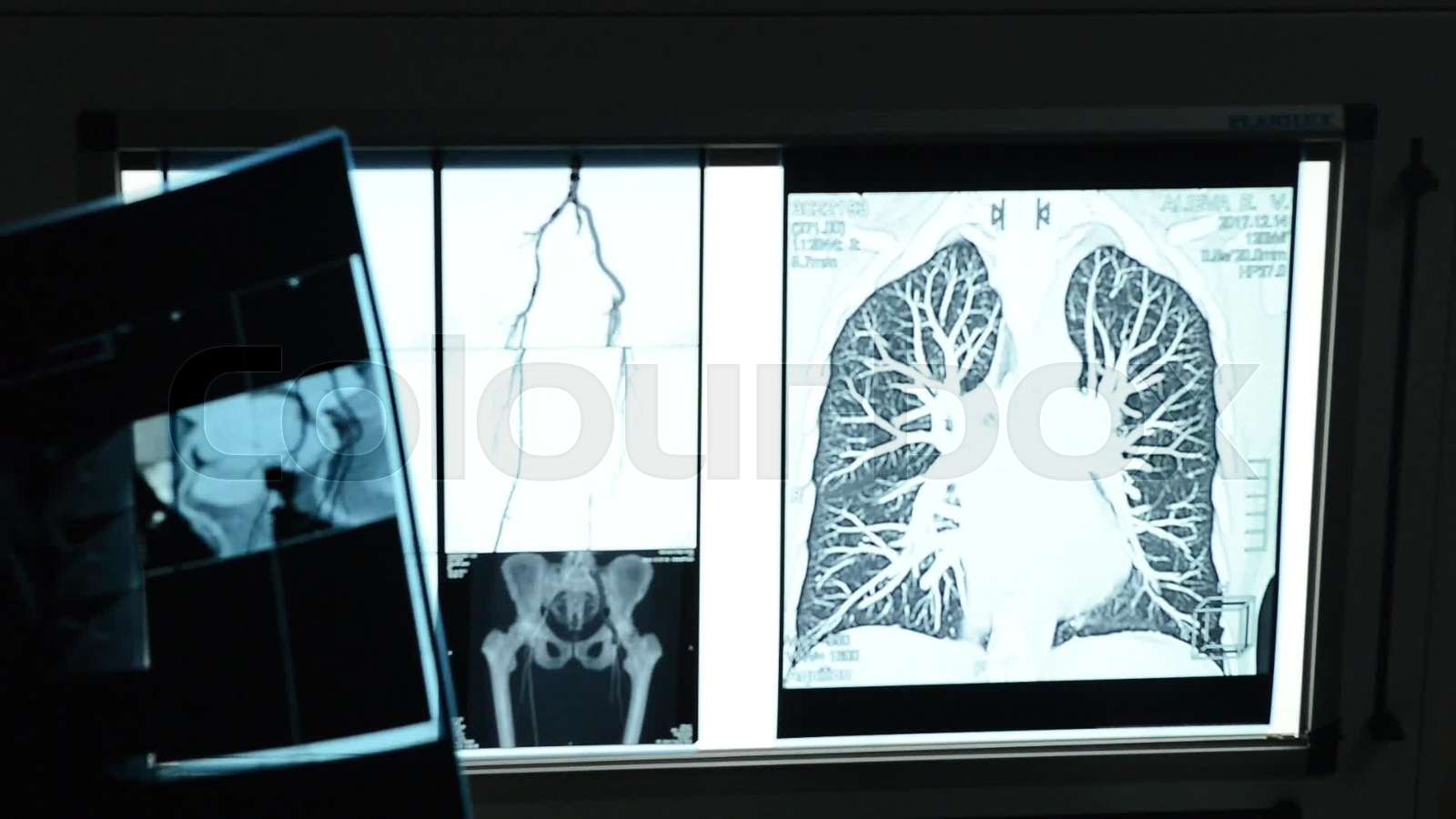 X-ray of internal organs in a medical clinic | Stock video | Colourbox