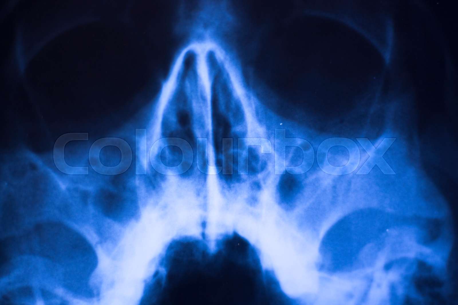 Medical xray face scan | Stock image | Colourbox