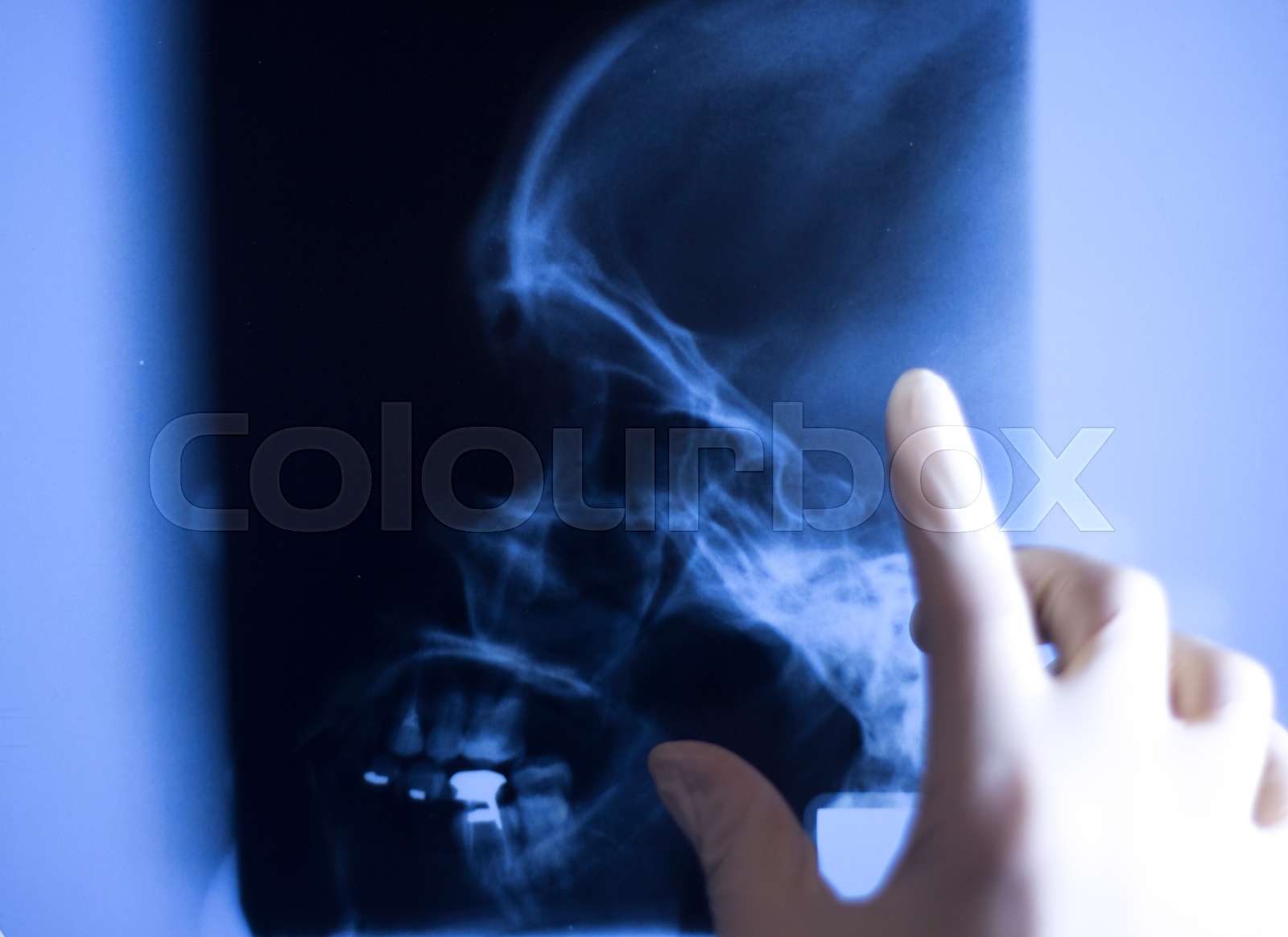 Medical xray face scan | Stock image | Colourbox