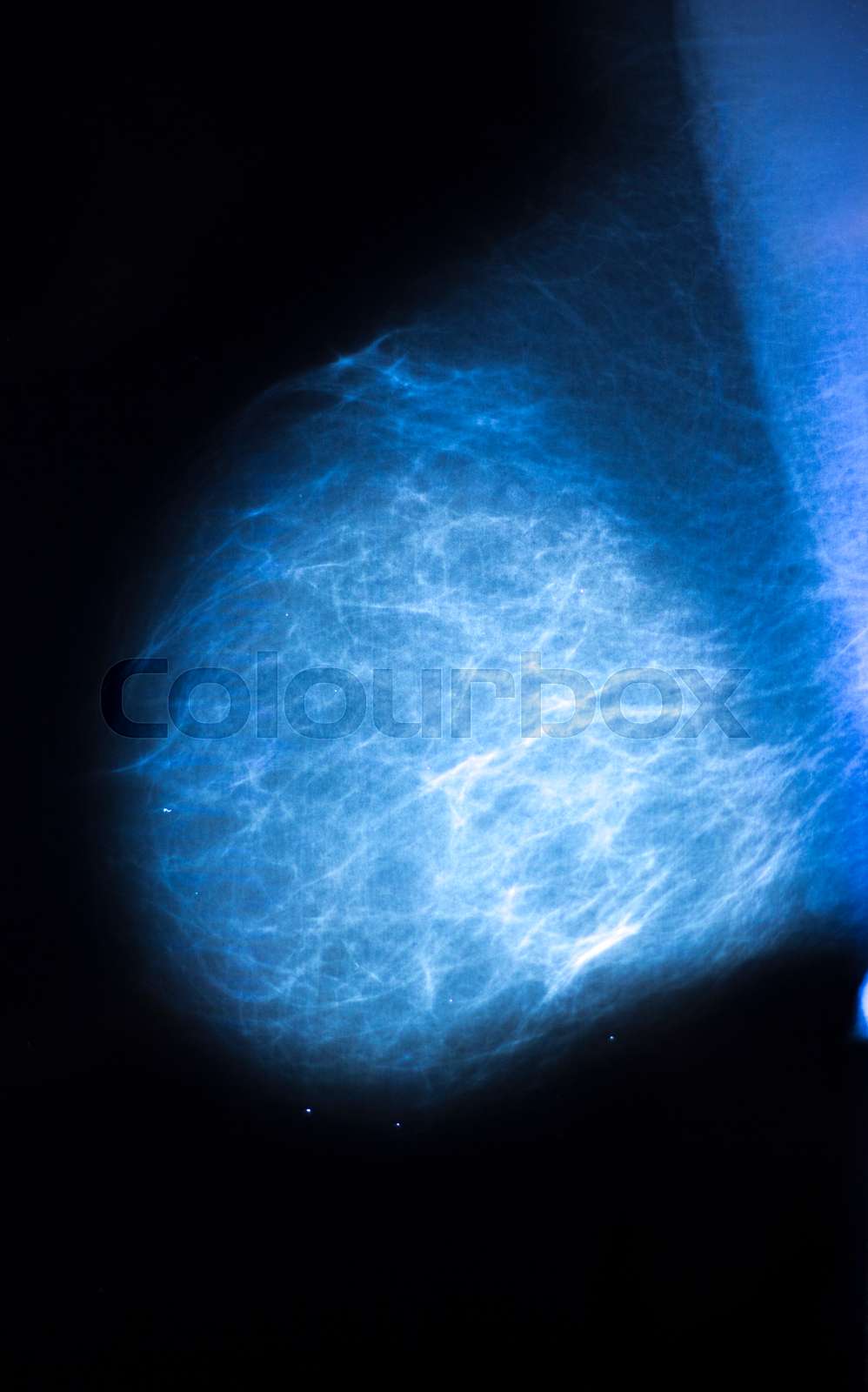 Xray breast scan mammogram | Stock image | Colourbox