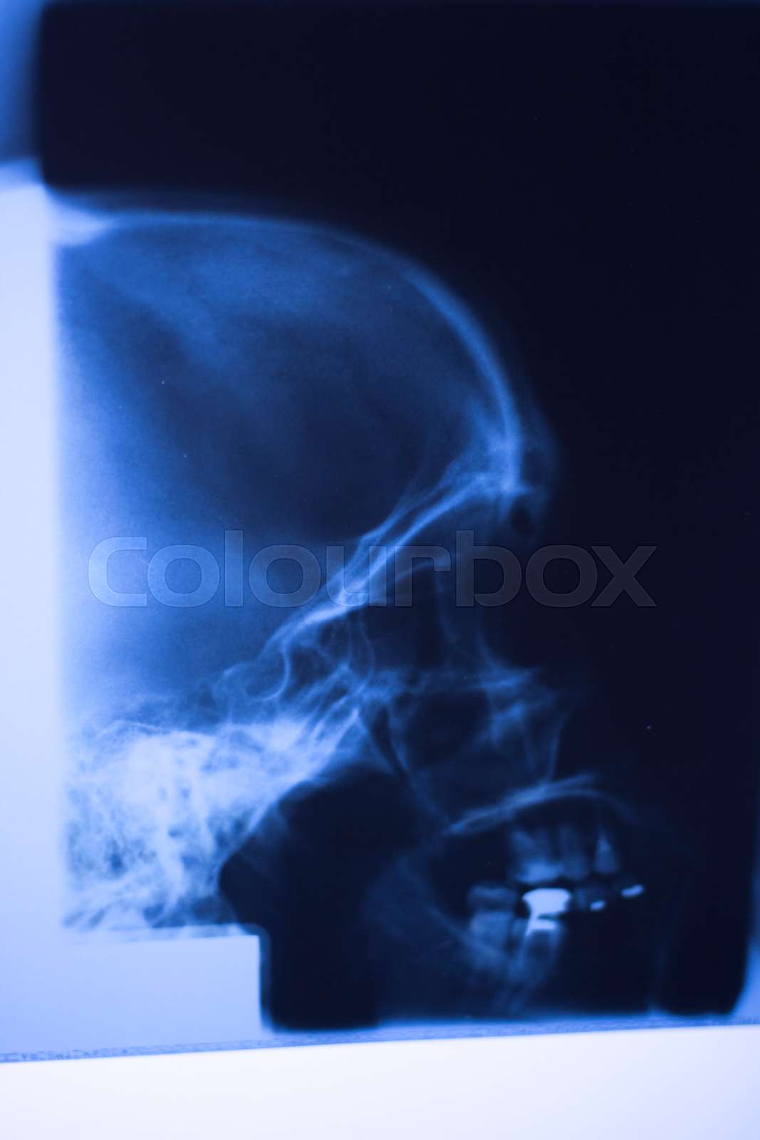 Medical xray face scan | Stock image | Colourbox