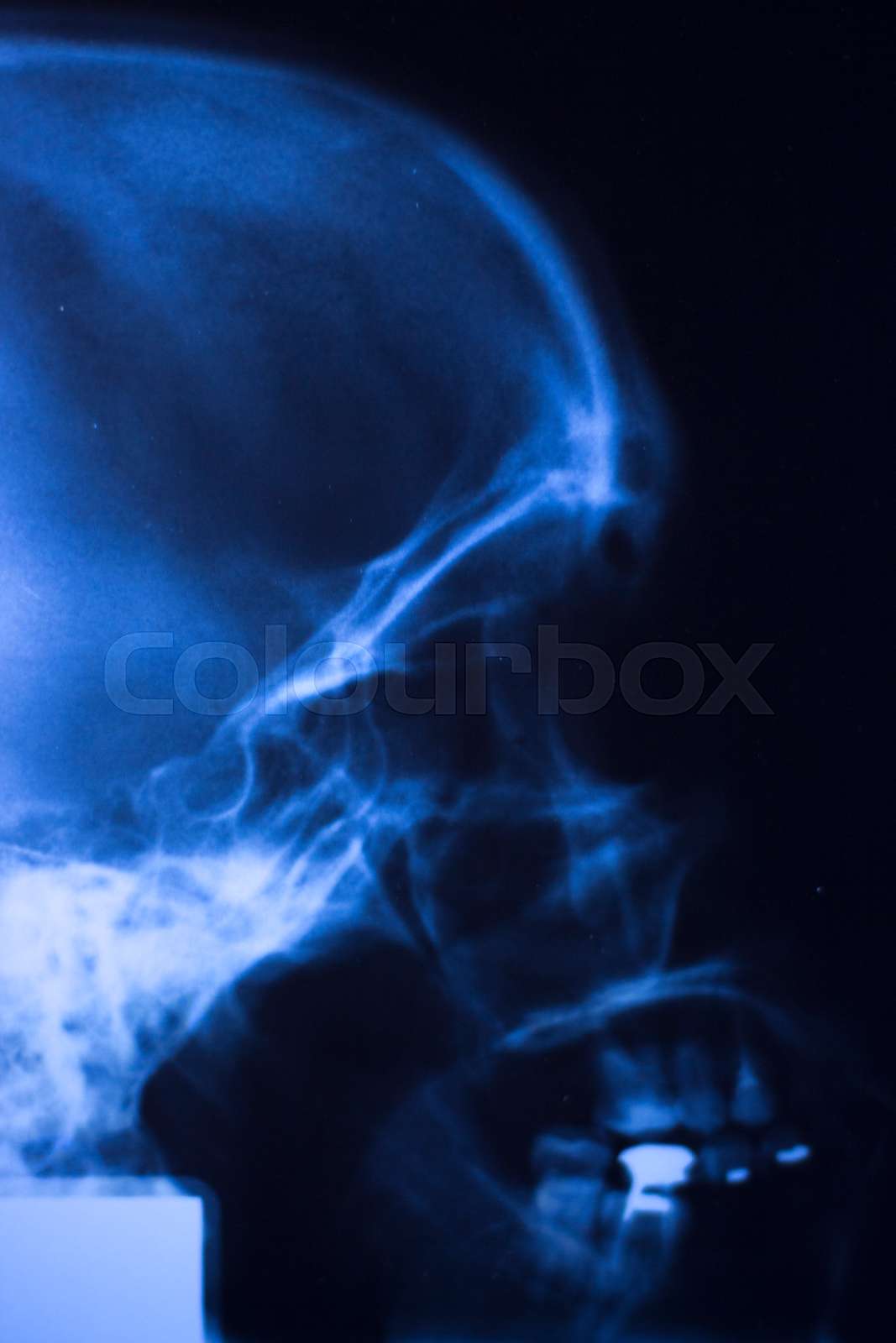 Medical xray face scan | Stock image | Colourbox