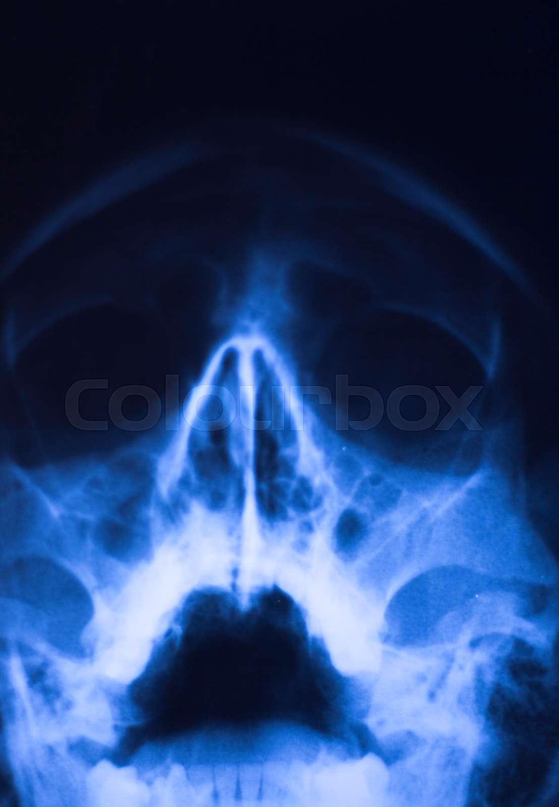 Medical xray face scan | Stock image | Colourbox