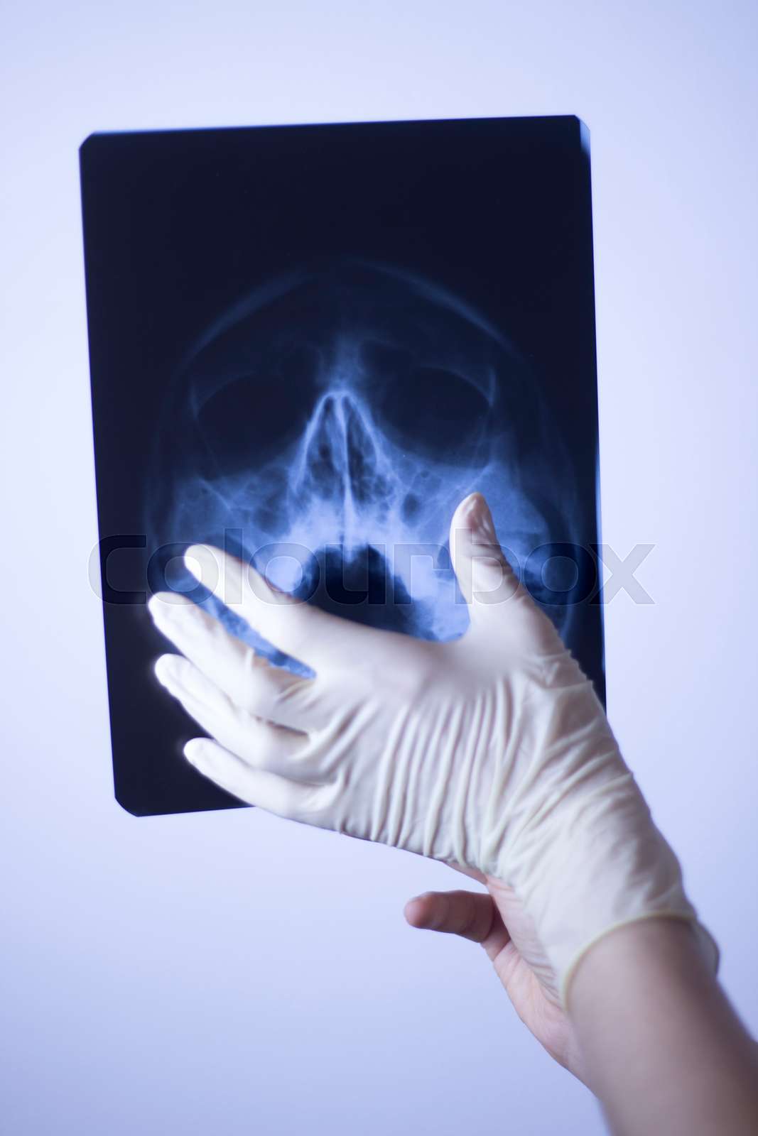 Medical xray face scan | Stock image | Colourbox