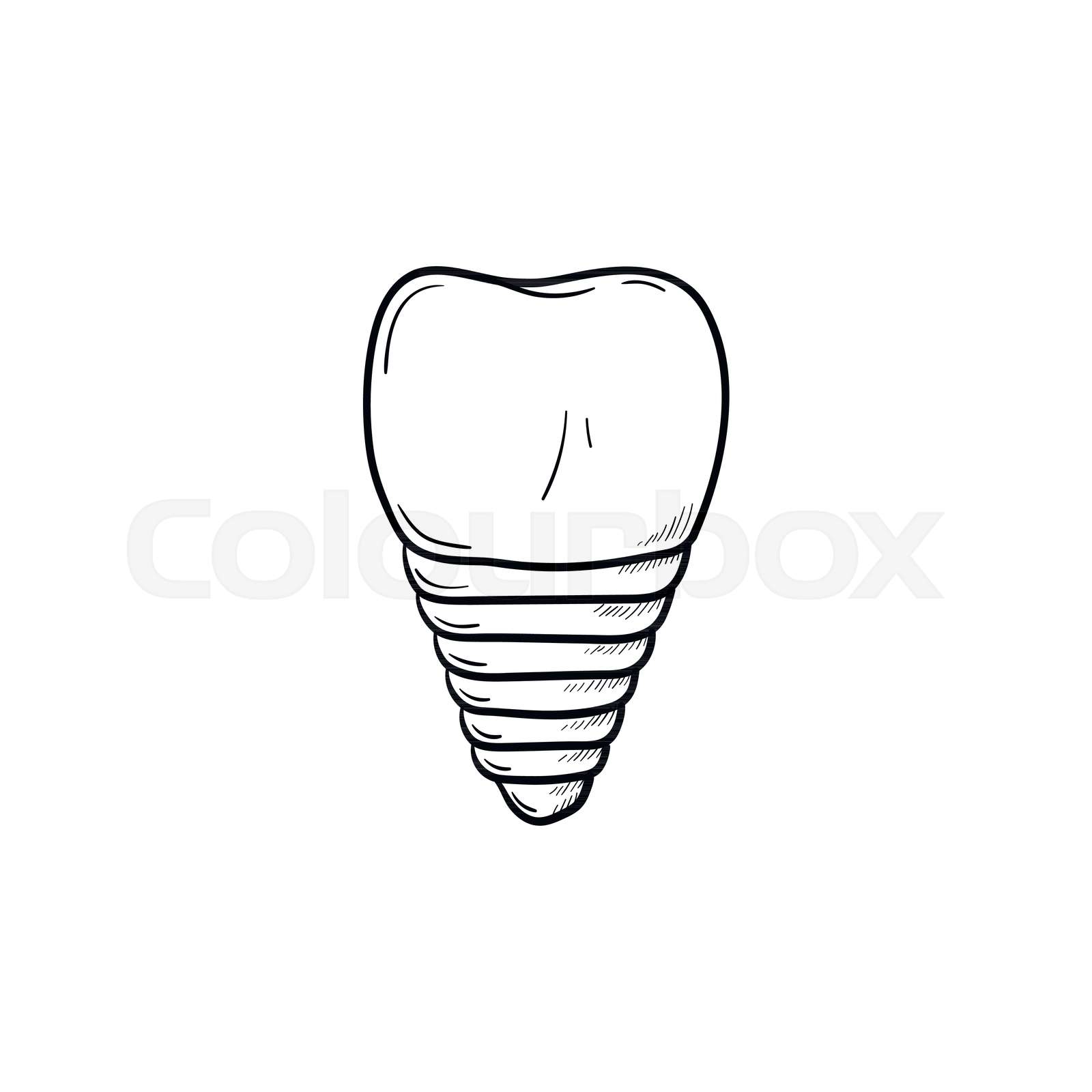 Dental implant hand drawn outline doodle icon. | Stock vector | Colourbox