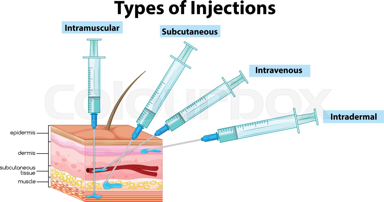 Types of Injections on White Background | Stock vector | Colourbox