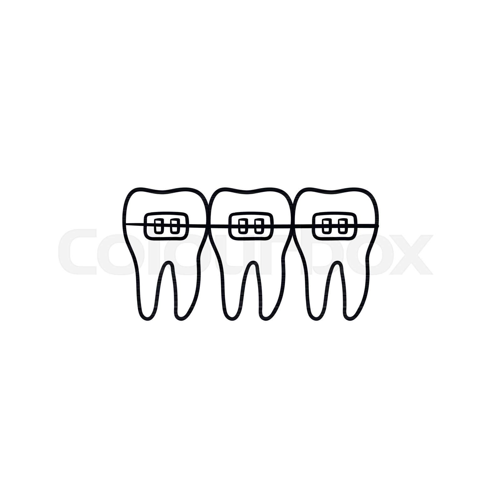 Dental braces hand drawn outline doodle icon. | Stock vector | Colourbox