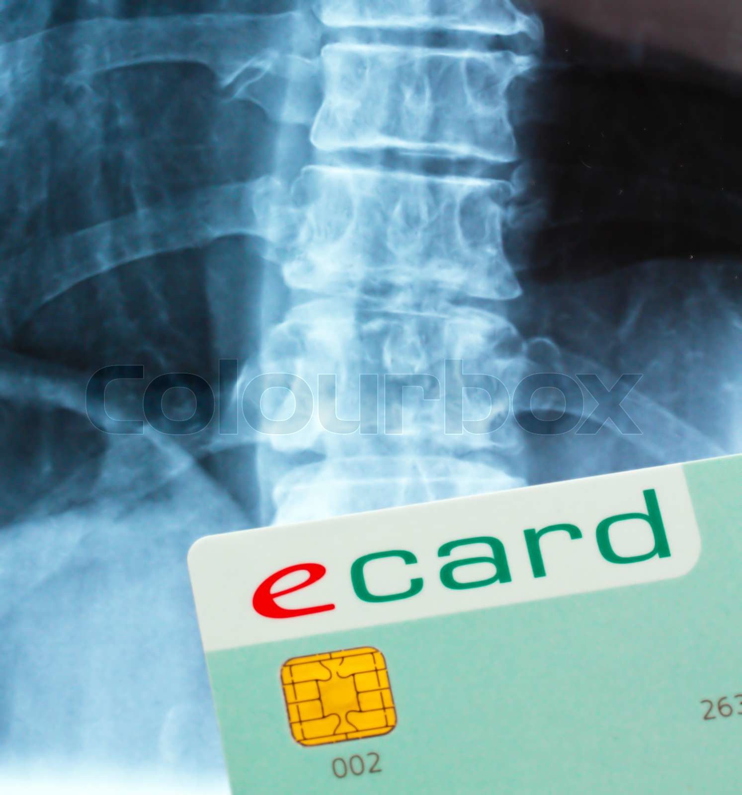 e-card to settle the medical bills of the austrian health insurance ...