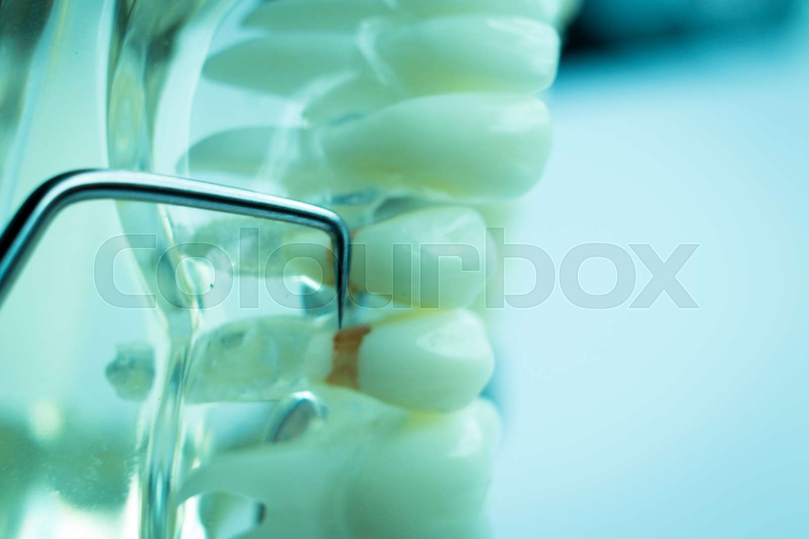 Dentist cleaning teeth | Stock image | Colourbox