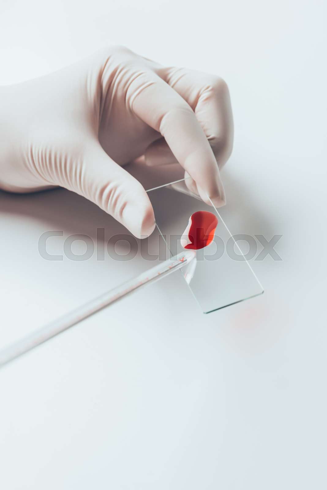 cropped shot of doctor pouring blood from pipette onto blood slide for ...