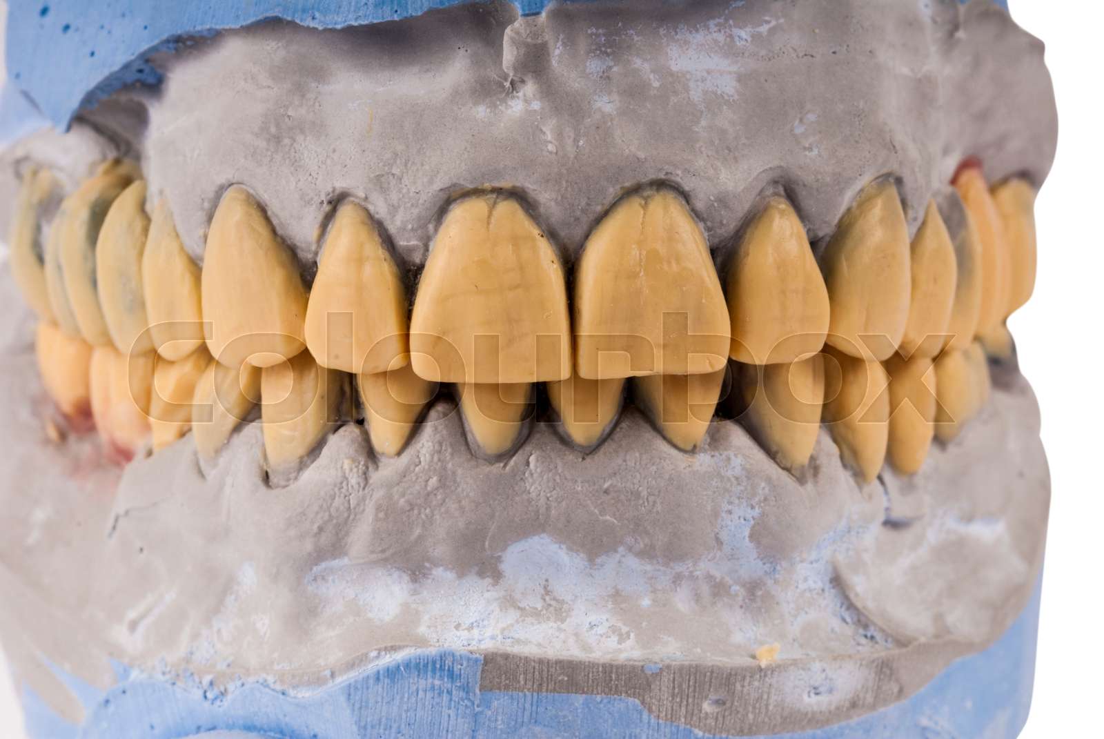 whole jaw gypsum impression | Stock image | Colourbox