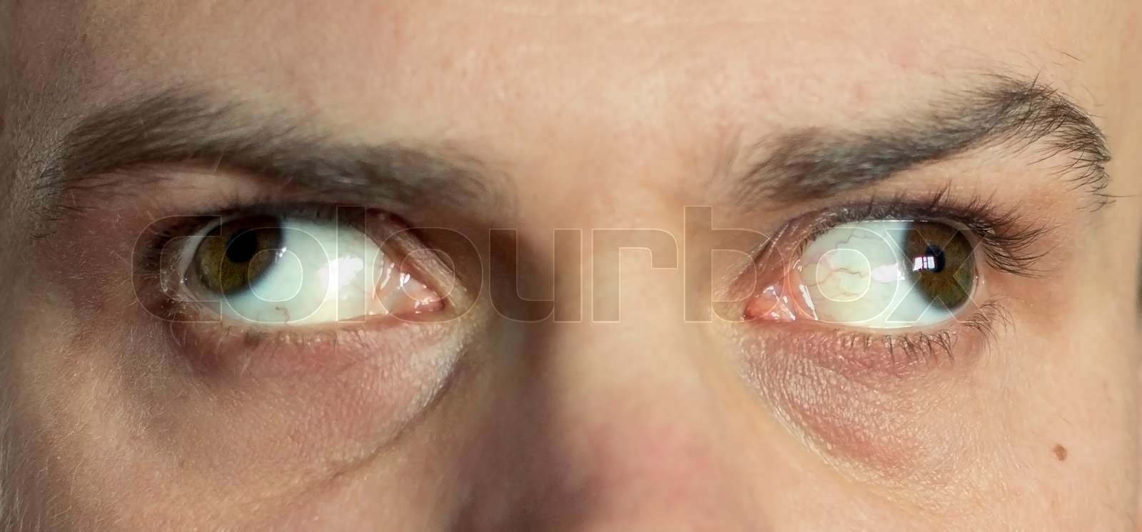 The man's eyes close-up look in different directions | Stock image ...
