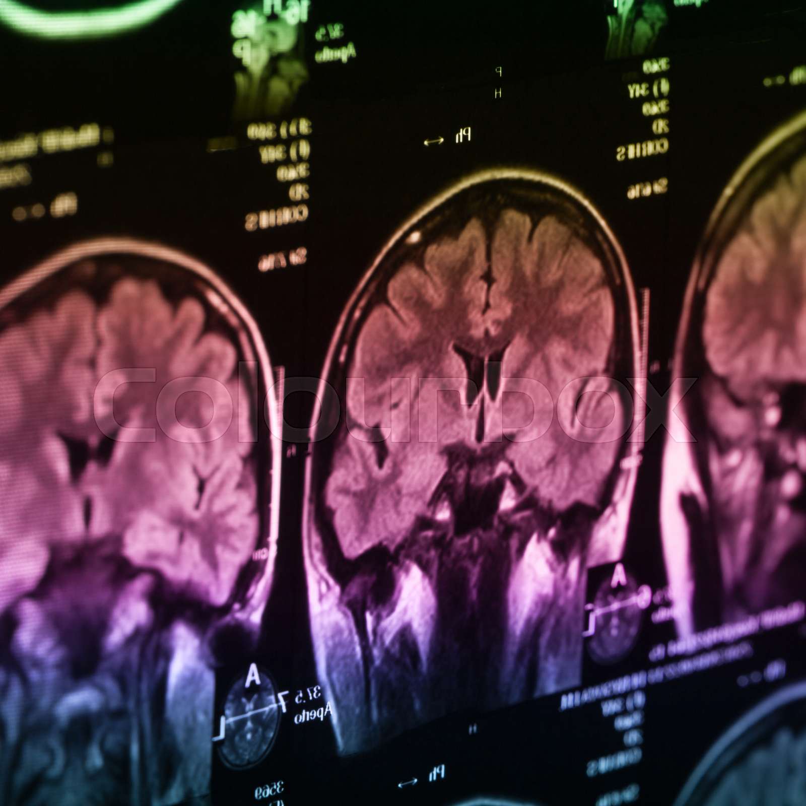 The X-ray of the human brain | Stock image | Colourbox