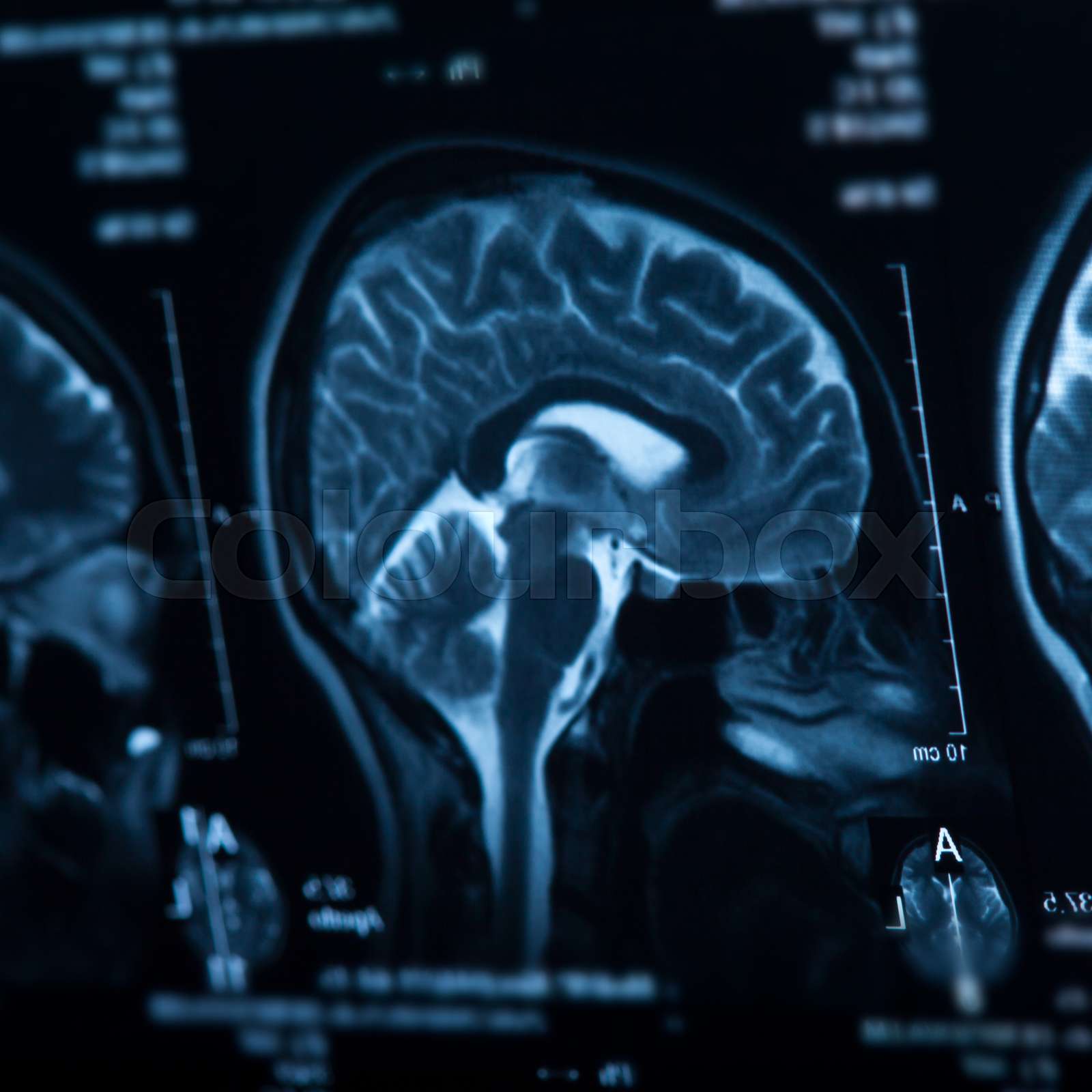 The X-ray of the human brain | Stock image | Colourbox