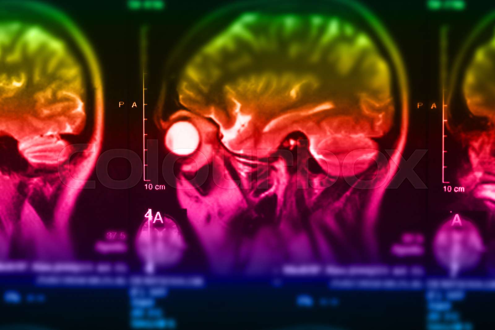 The X-ray of the human brain | Stock image | Colourbox