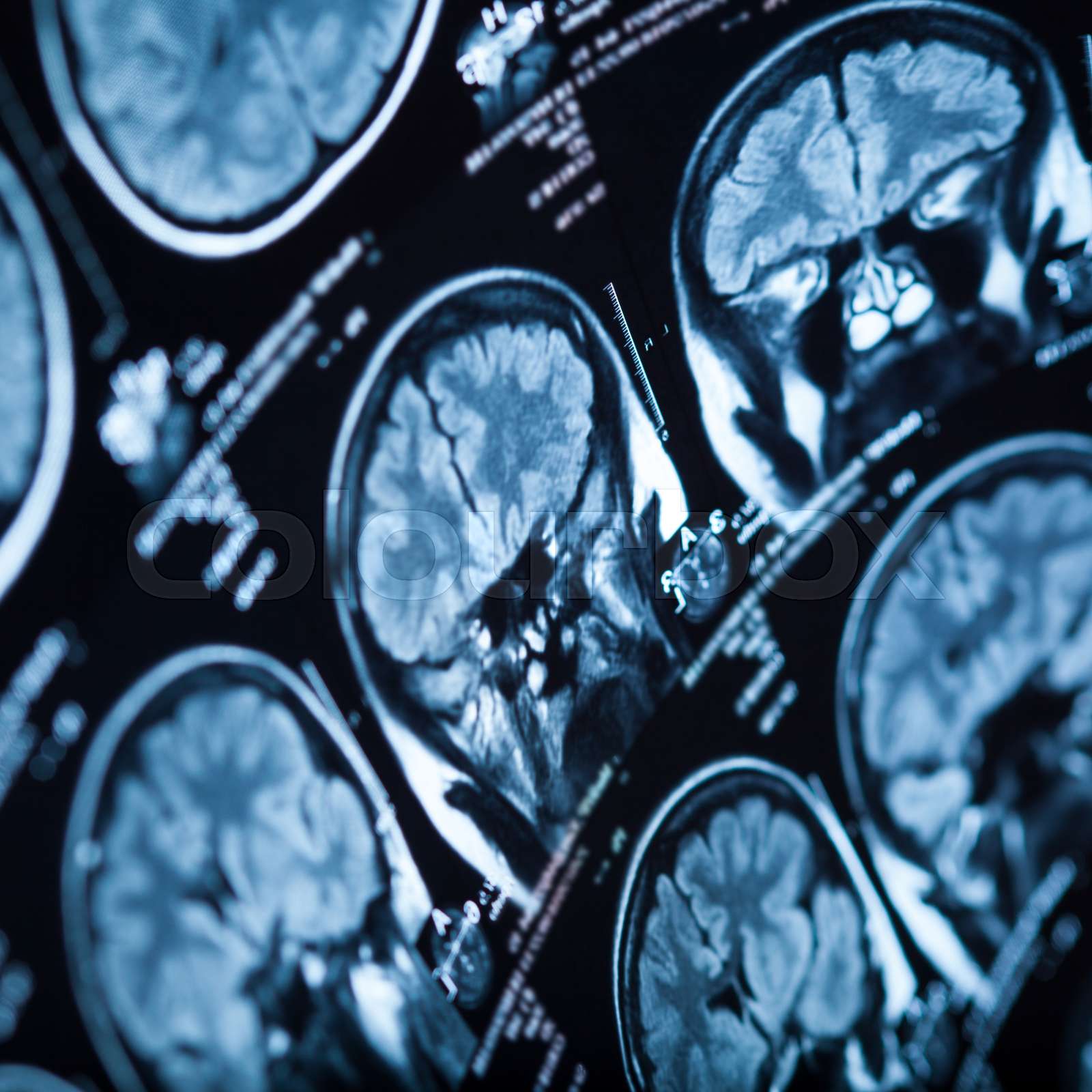 The X-ray of the human brain | Stock image | Colourbox