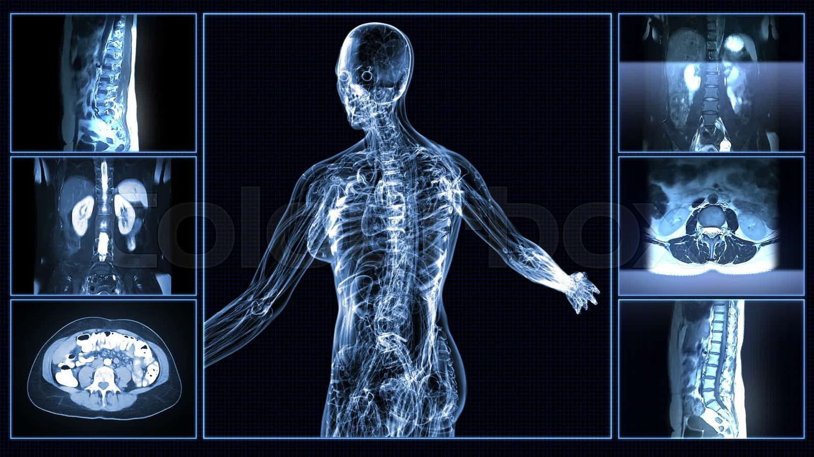 Female Body MRI Scan | Stock video | Colourbox