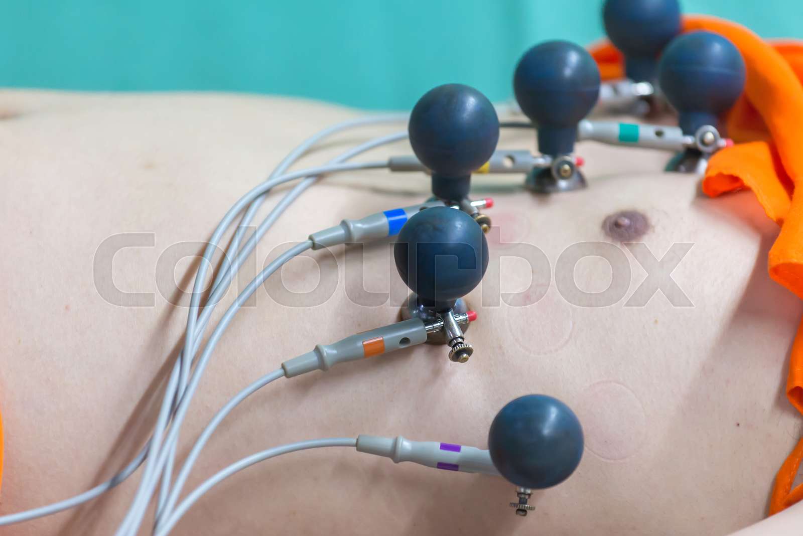 ECG or EKG of man with electrodes for electrocardiogram records on bed ...
