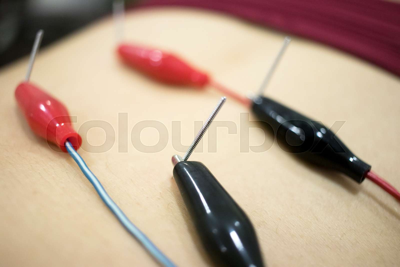 Dry needling EPI needle | Stock image | Colourbox