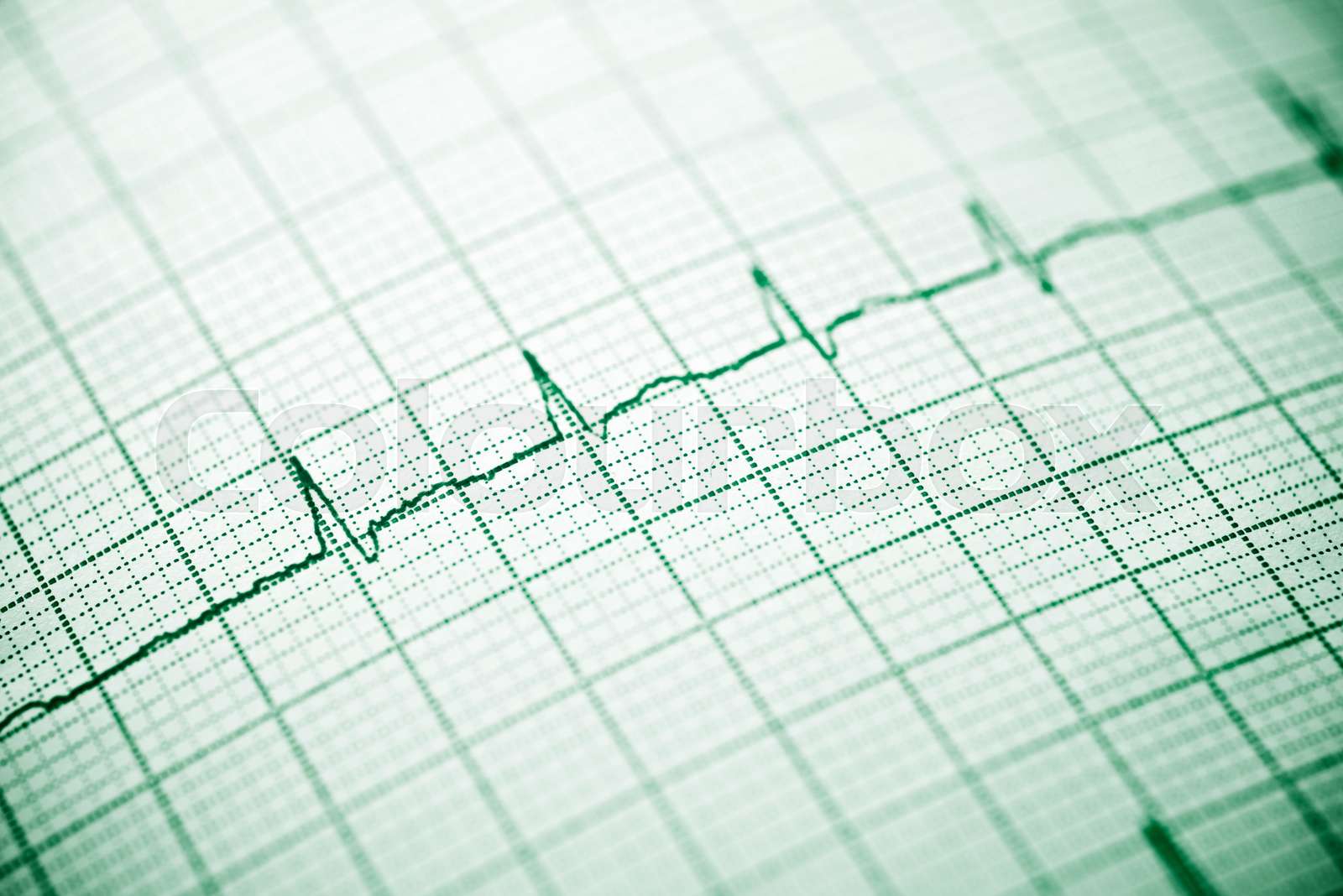 Electrocardiogram | Stock image | Colourbox