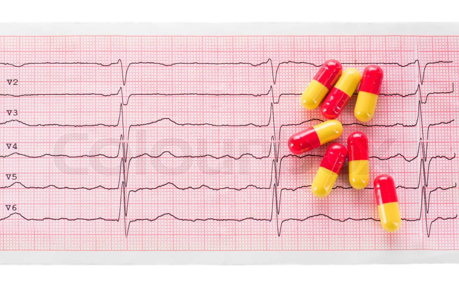 Cardiology Macro of ECG graph and cardio pills | Stock image | Colourbox