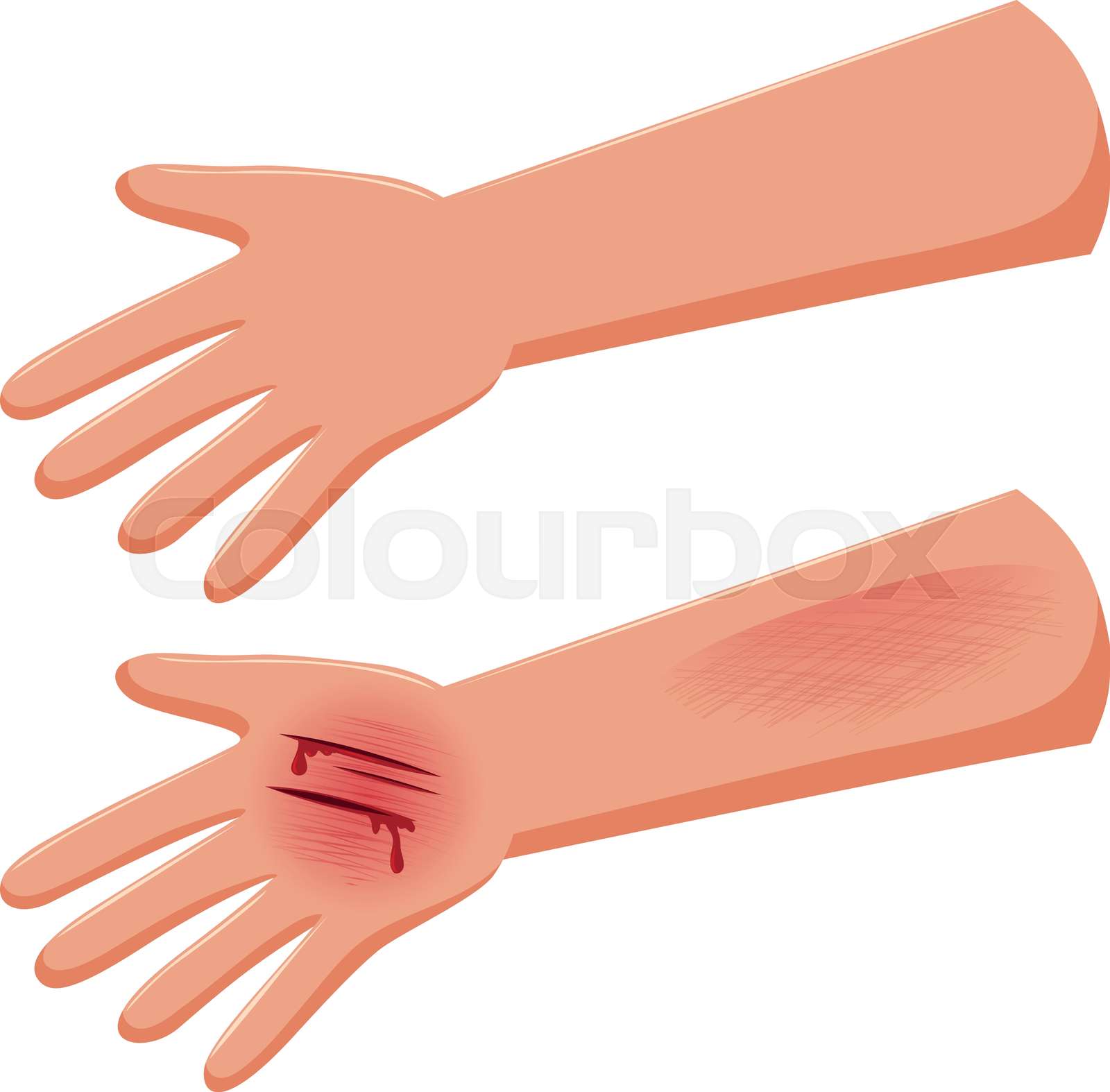 Set of injure hand | Stock vector | Colourbox