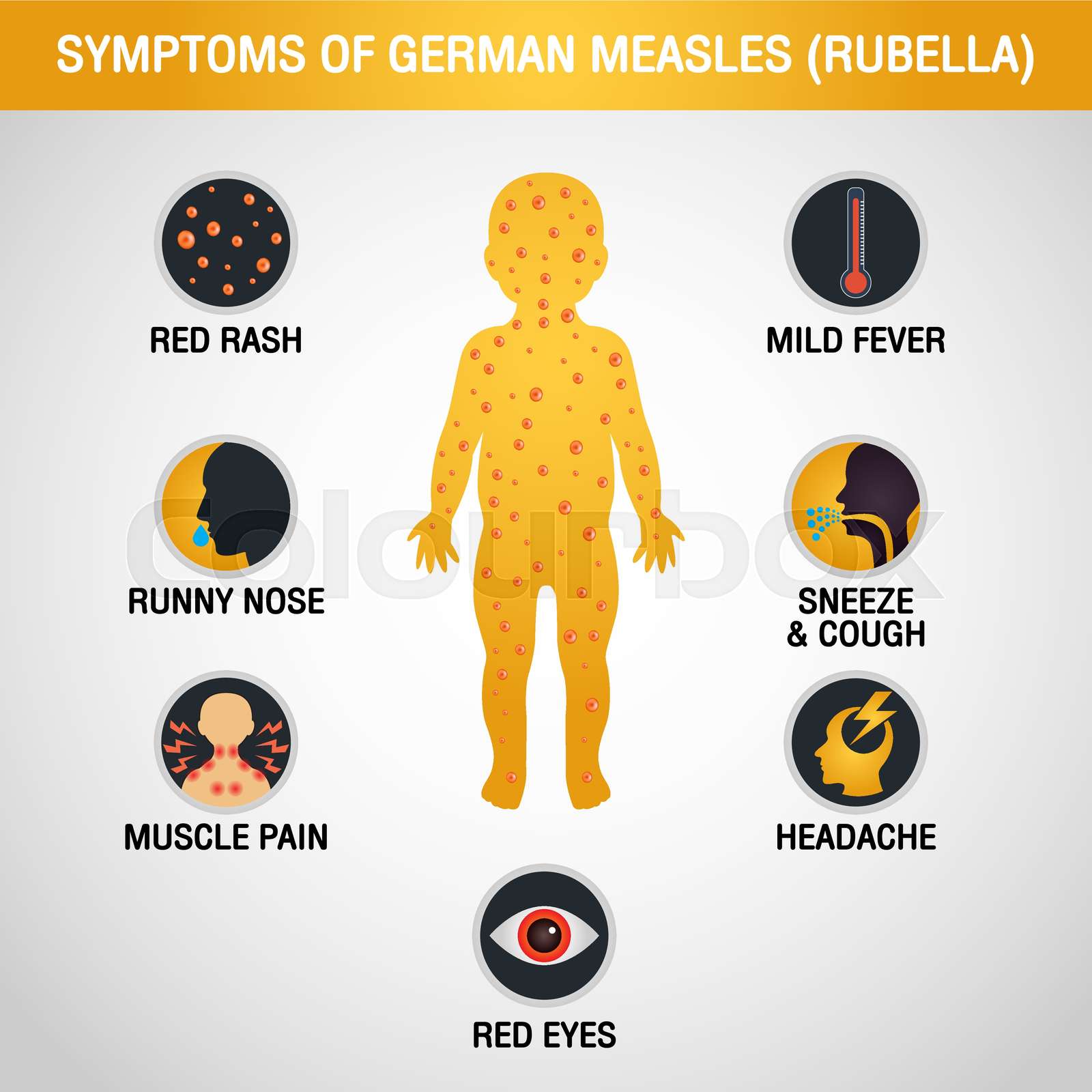 Mild Rubella Symptoms