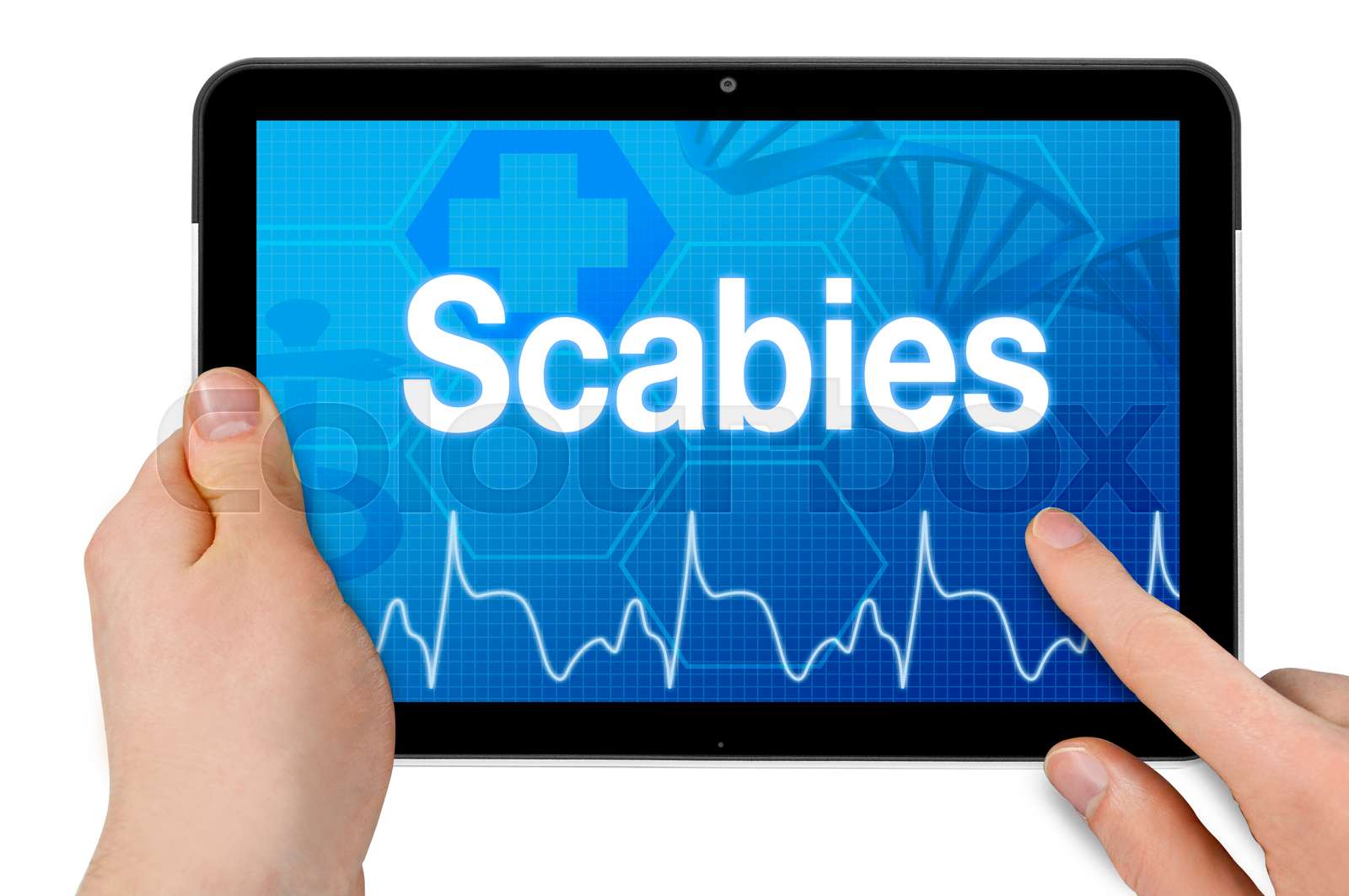 Tablet mit Diagnose Scabies Krätze | Stock Bild | Colourbox