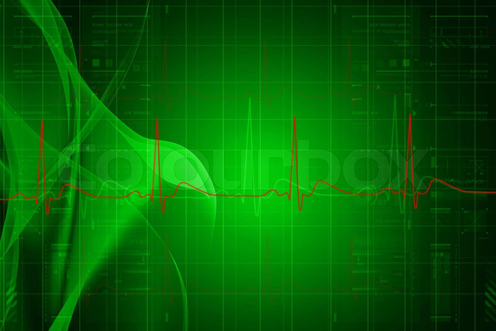 ECG | Stock image | Colourbox