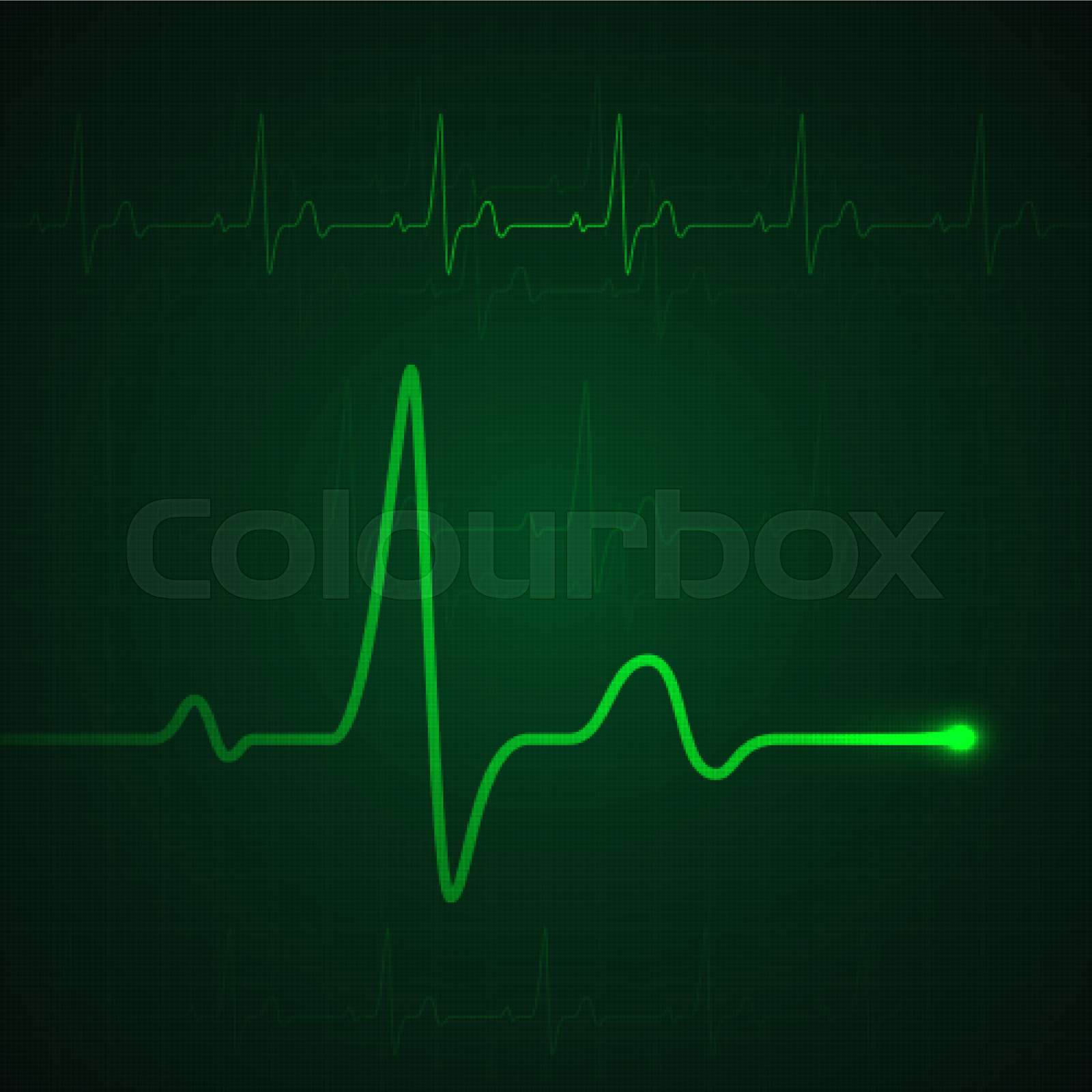 Heart pulse on green display. Heartbeat graphic or cardiogram. Medicine ...