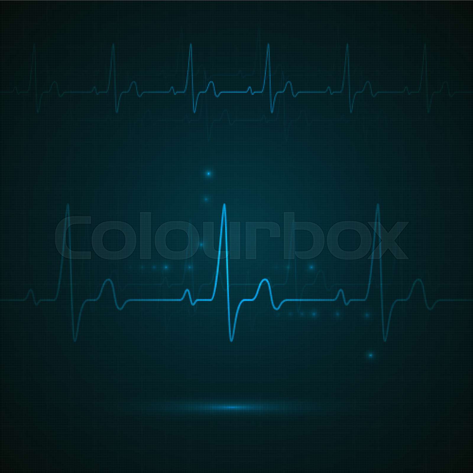 Heart rate on blue display. Heartbeat monitoring. vector | Stock vector ...