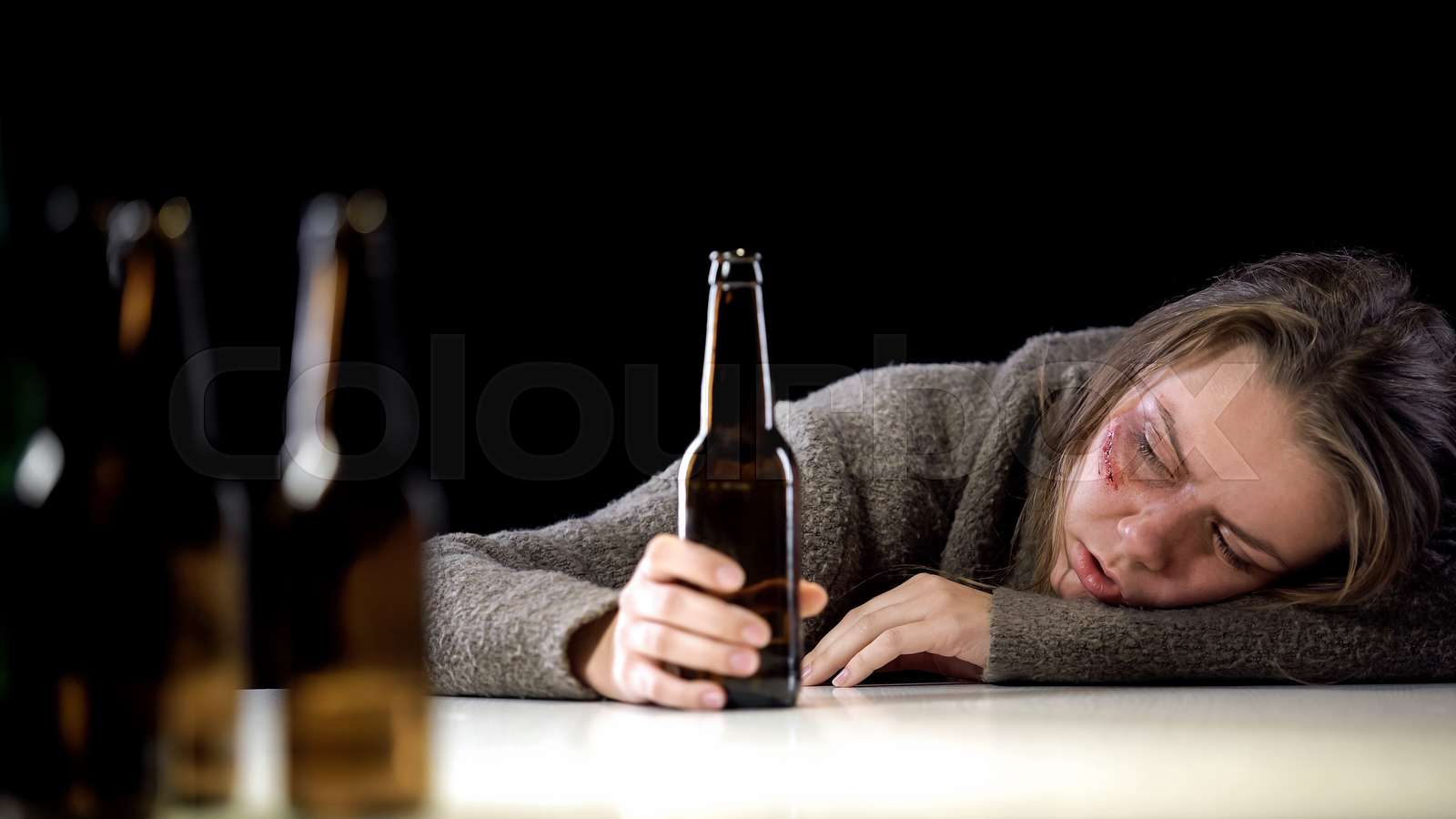 Intoxicated female with face wound holding beer bottle, lying on table ...