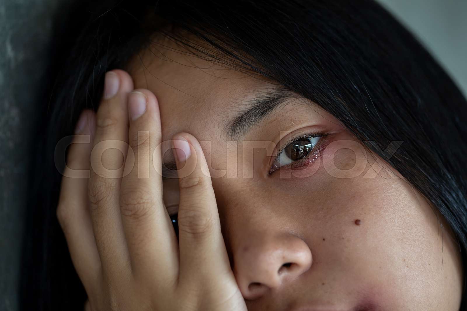 Close up of a crying teen girl with bruised skin and black eyes ...