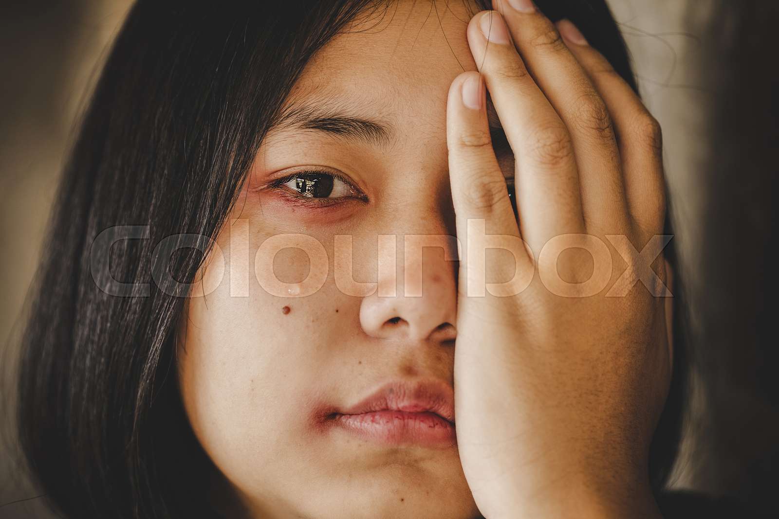 Close up of a crying teen girl with bruised skin and black eyes ...
